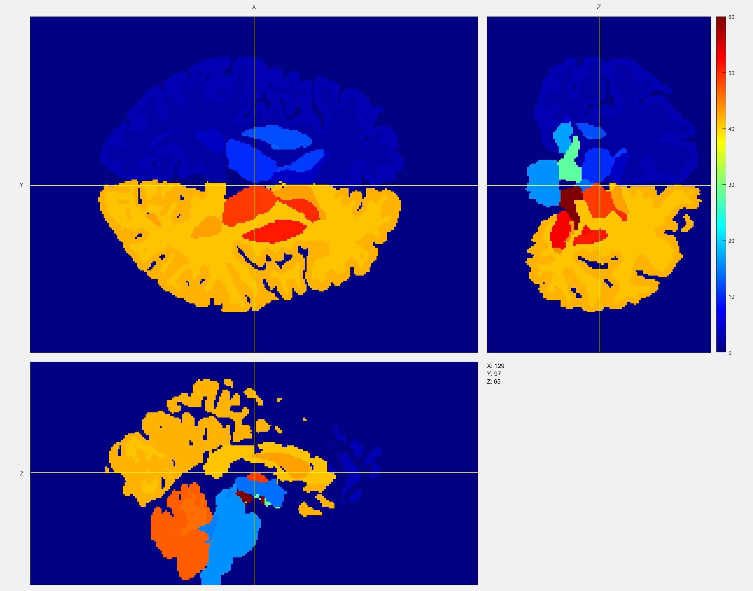 Developing a Cerebral Blood Flow Atlas for Blood Flow Mapping