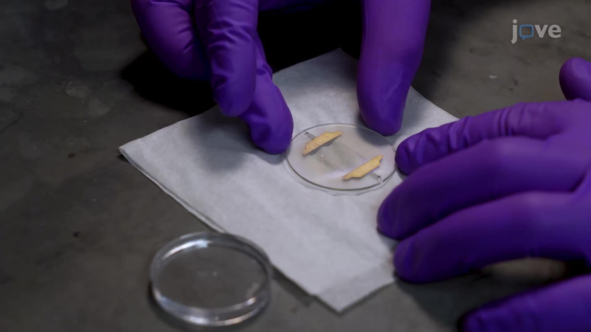 비디오: Fluorescence Photoactivation Imaging of Neurofilament Transport in ...