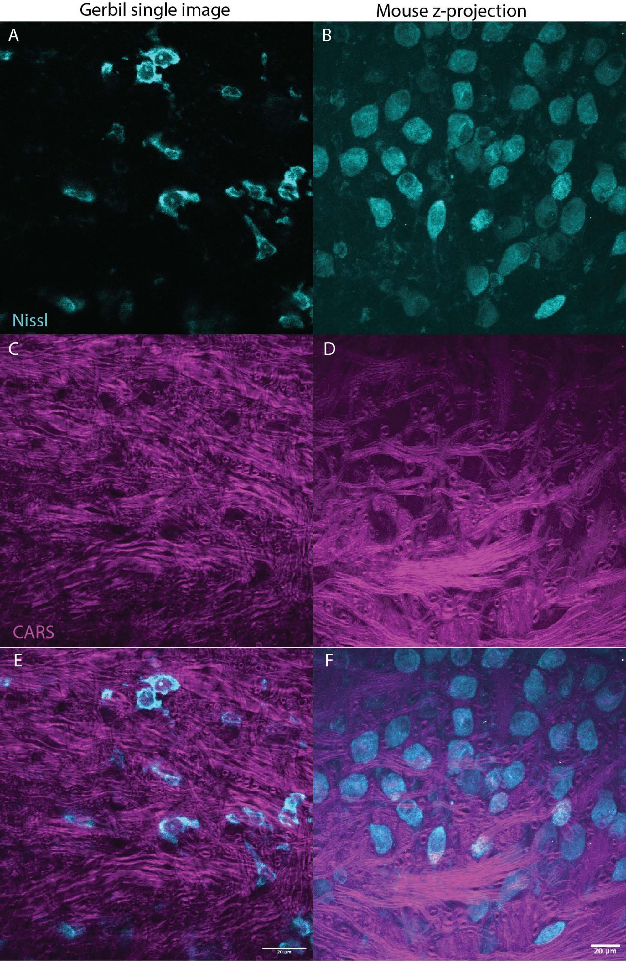Coherent Anti-Stokes Raman Spectroscopy to Visualize Myelinated Neurons ...