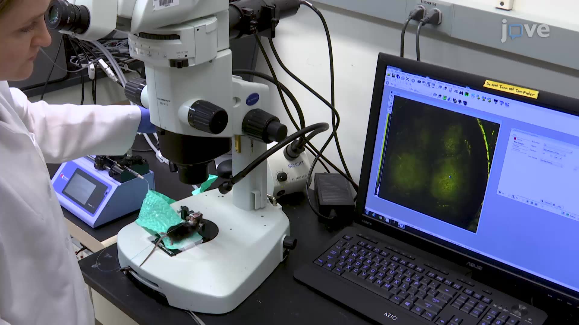 Video In Vivo Imaging Of Cerebrospinal Fluid Transport In A Mouse