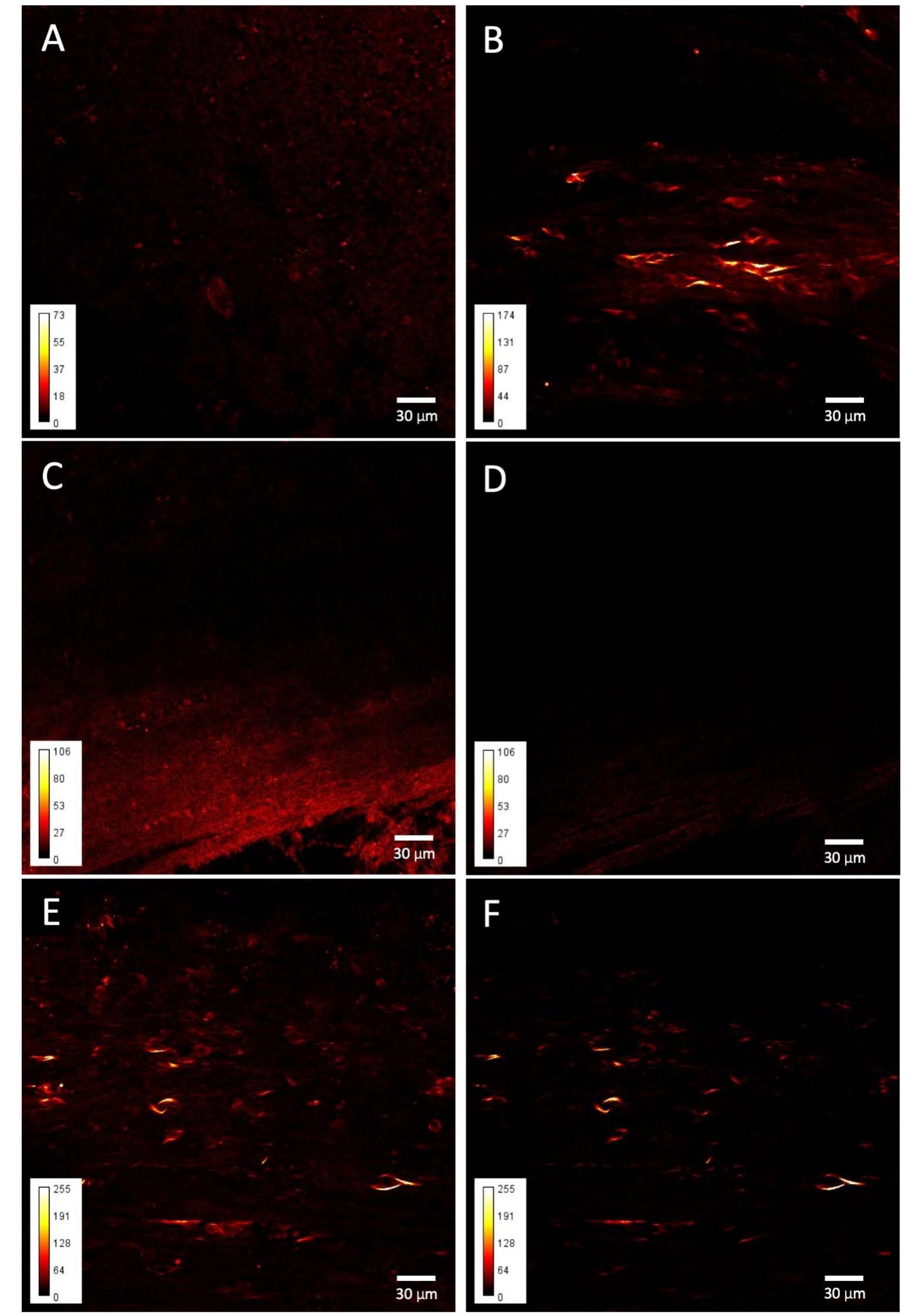 Second Harmonic Generation Imaging in a Rat Model to Study Tubulin Defects