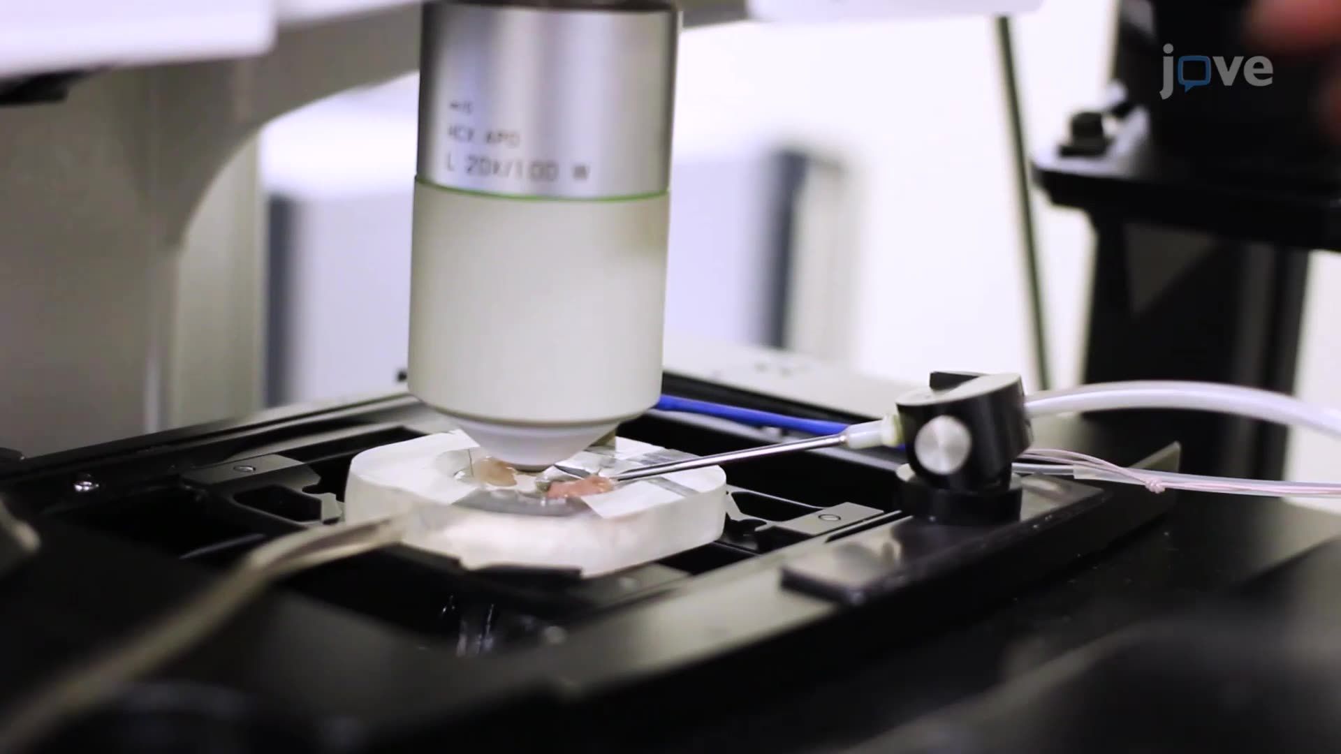 비디오: Imaging Fast Calcium Transients in Mouse Nerve Endings Using ...