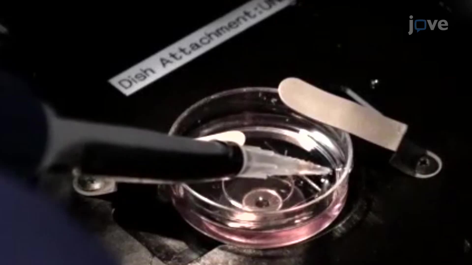 Video: Real-Time In Vitro Imaging of Axonal Branching in Mouse Cortical ...