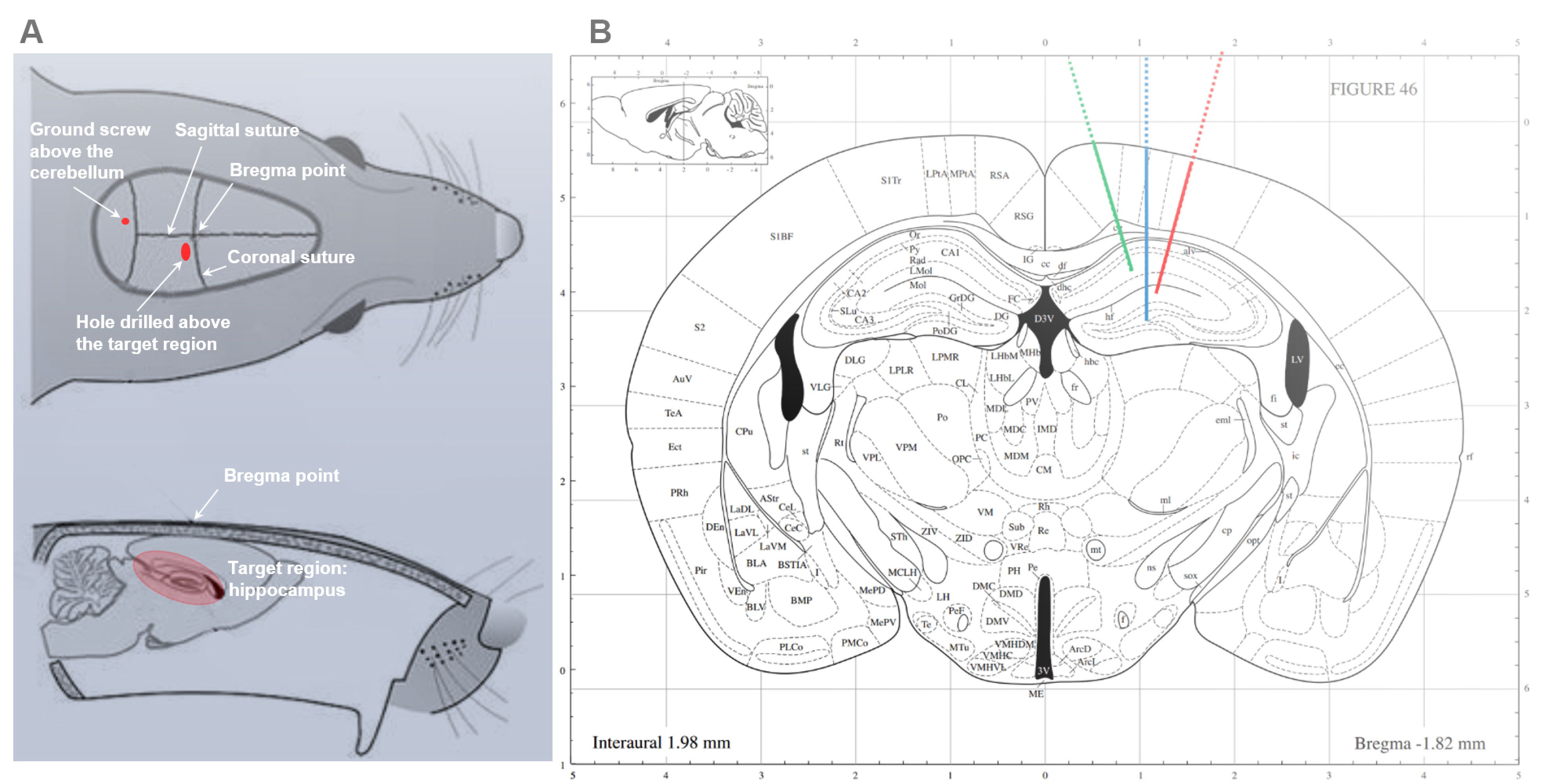 Electrophoretic Delivery of GABA into the Epileptic Focus of an ...