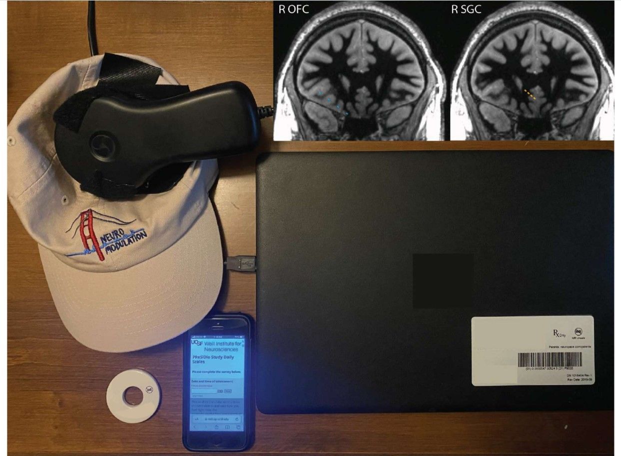 Neurostimulation System Setup and Symptom Collection for Personalized ...