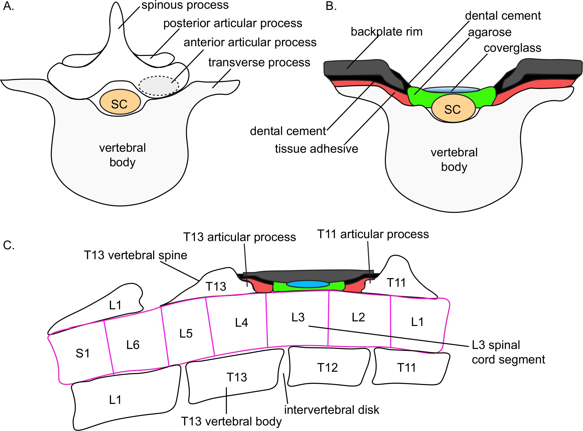 Spinal Cord Window Implantation in a Mouse for In Vivo Imaging