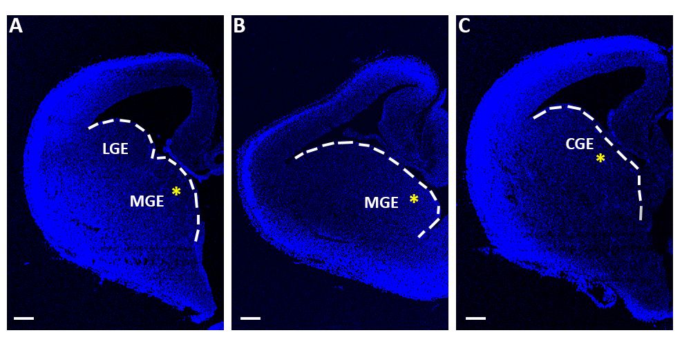 Agarose-Embedded Electroporation-Assisted Gene Transfer in Mouse ...