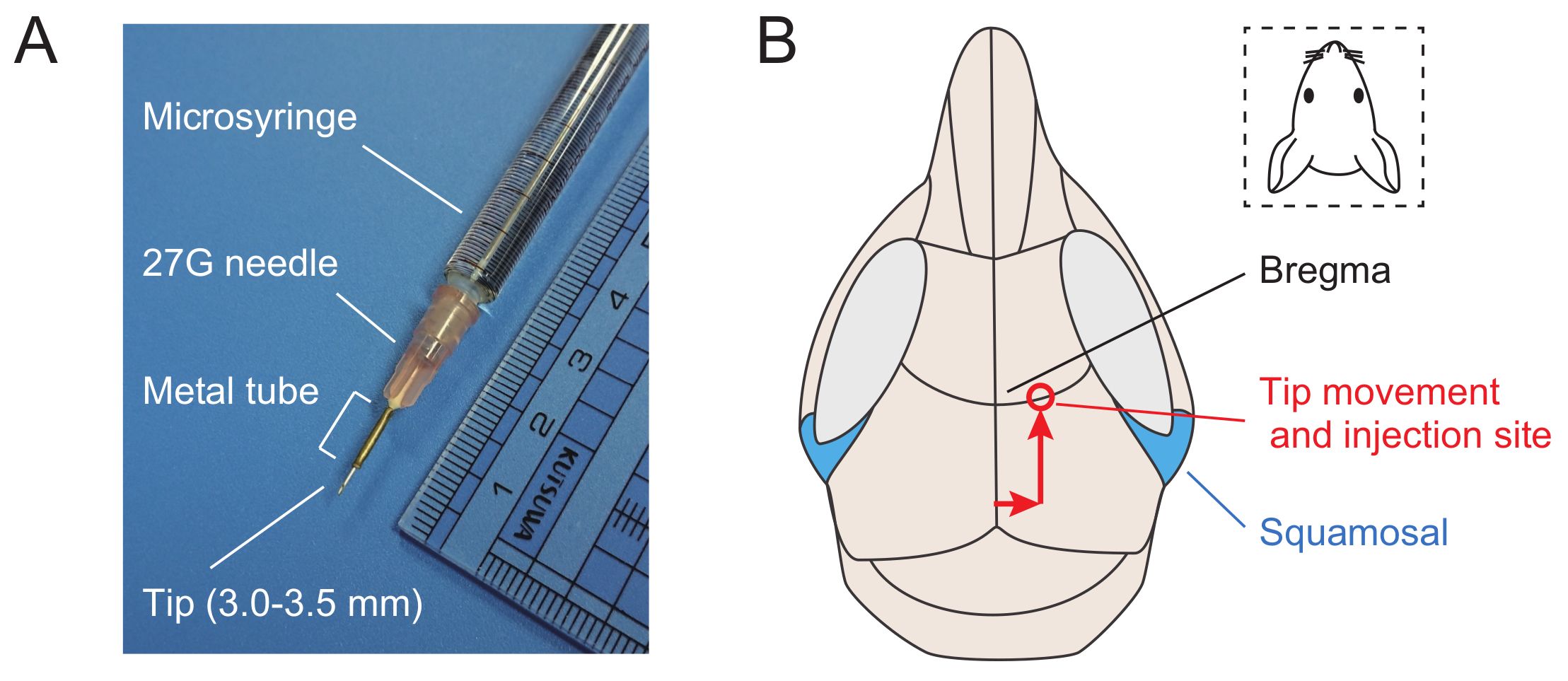 Intracerebroventricular Treatment with Resiniferatoxin for TRPV1 ...