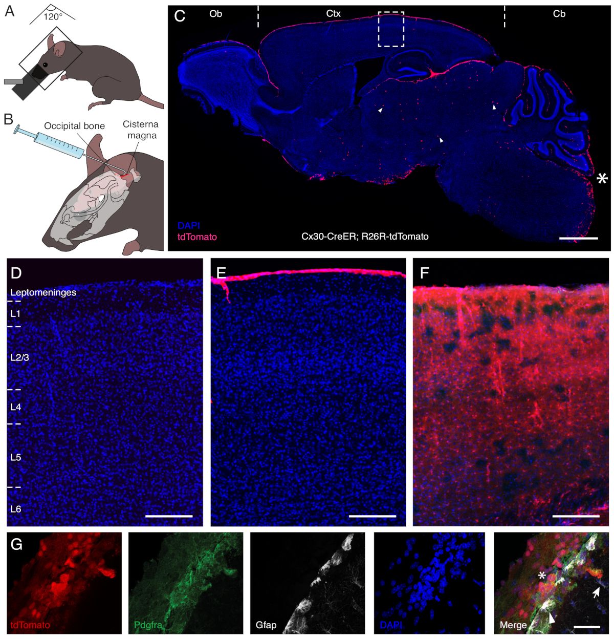 Targeted Drug Delivery in a Mouse Model via Cisterna Magna Injection
