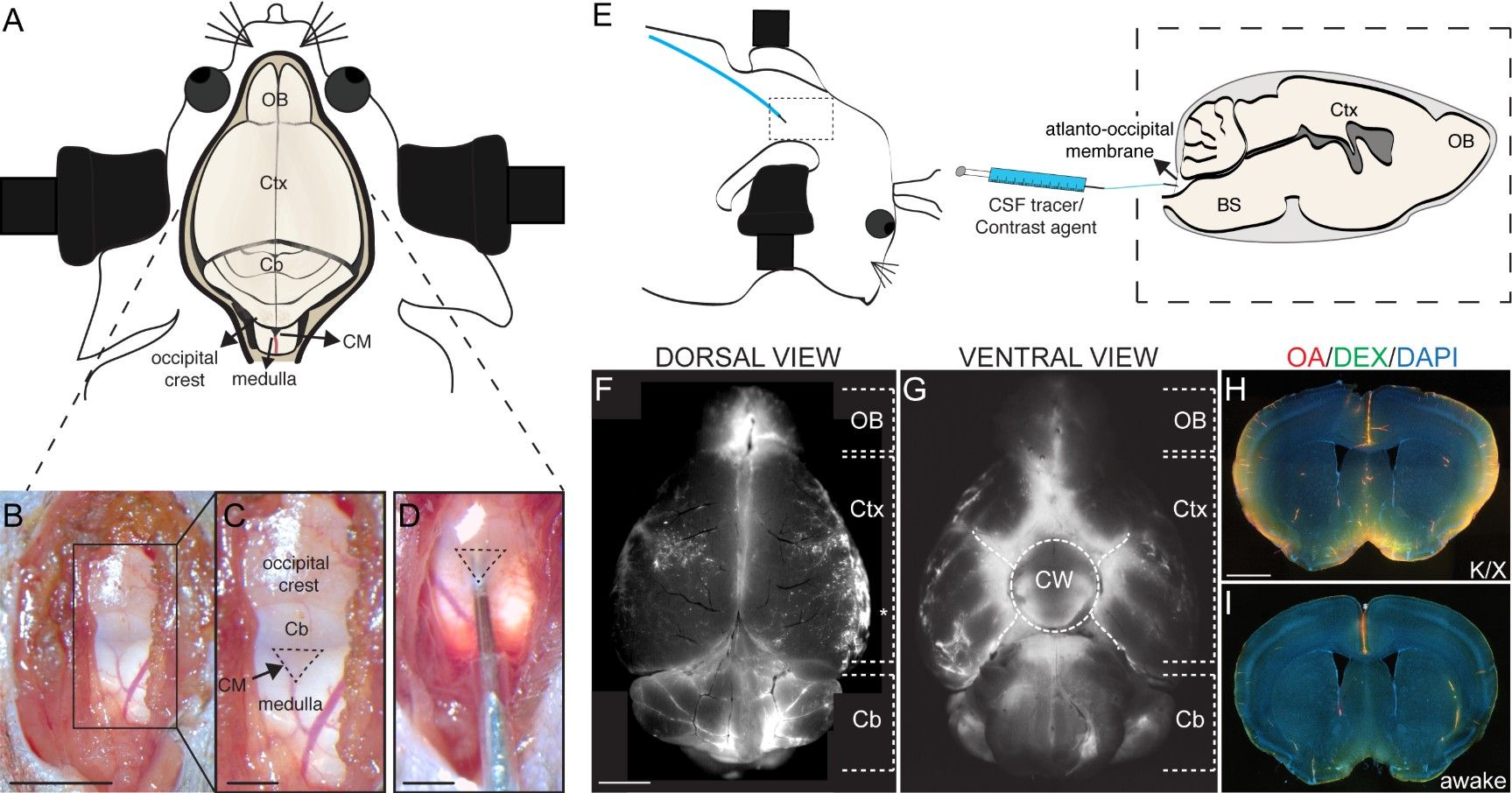 Cannula Implantation into the Cisterna Magna in a Mouse Model