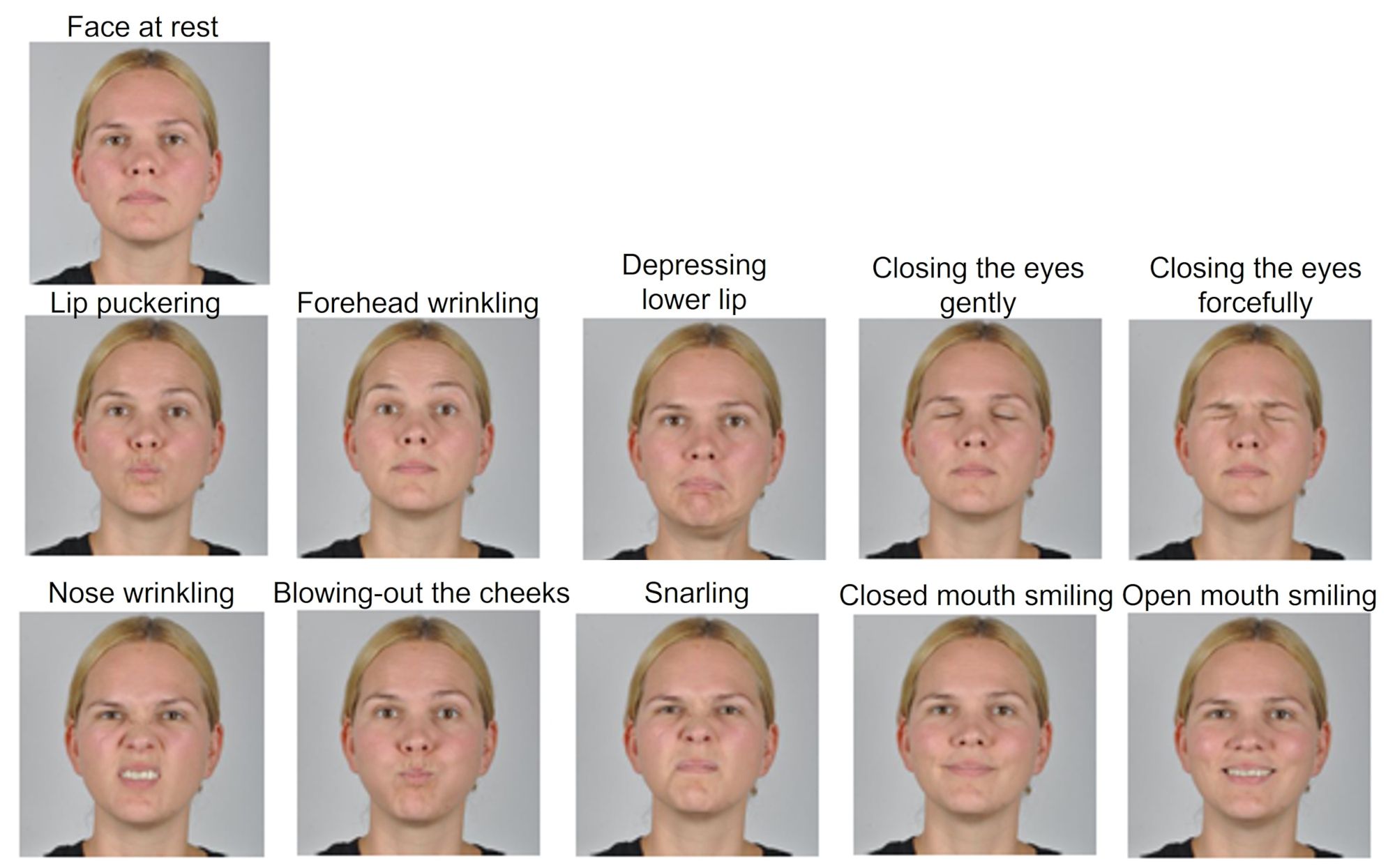 Wireless Surface Electromyography Recording of Facial Muscle Activity ...