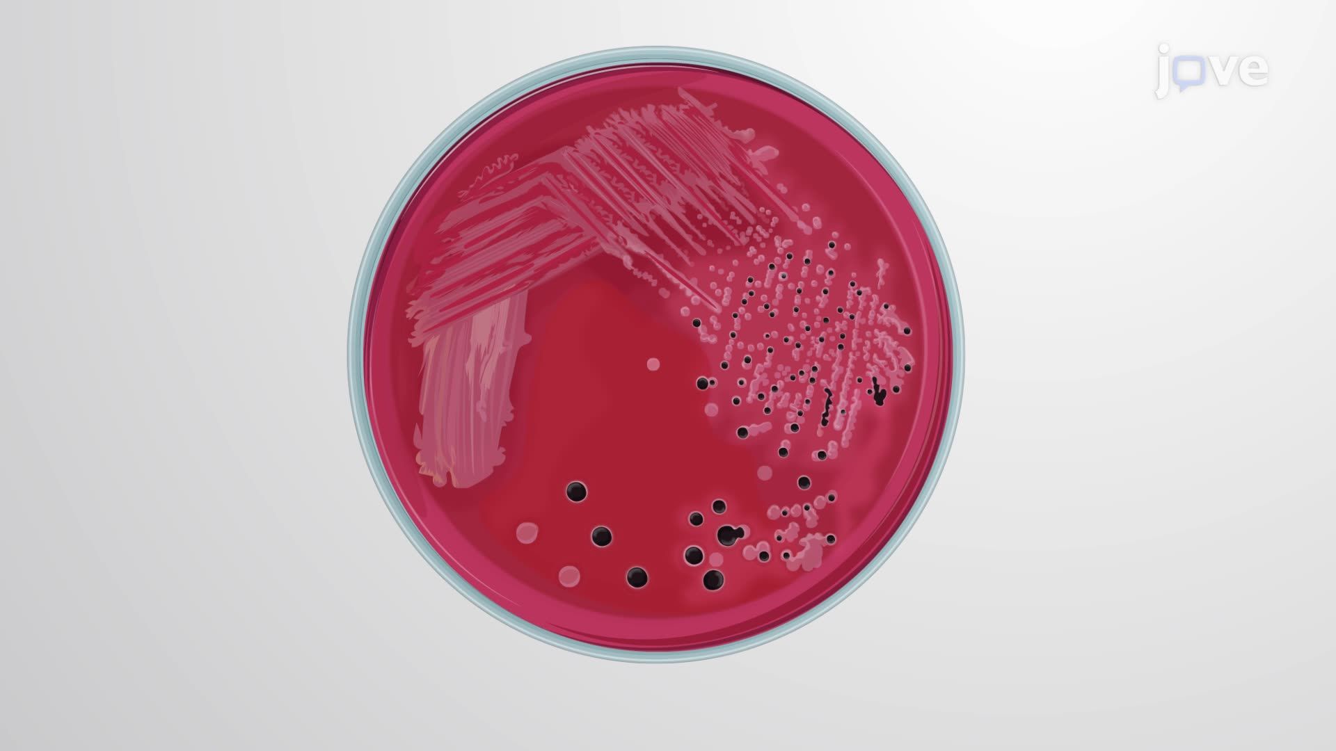 Video: Arricchimento selettivo e identificazione delle specie di Salmonella utilizzando lisina ...