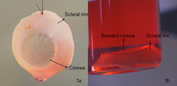 A Simplified Technique for In situ Excision of Cornea and Evisceration ...
