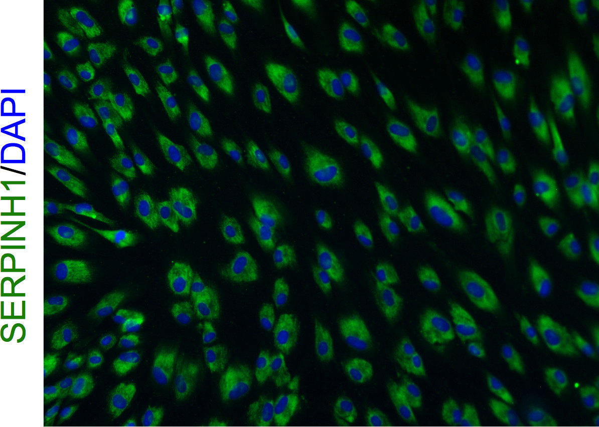 Skin Punch Biopsy Explant Culture for Derivation of Primary Human ...