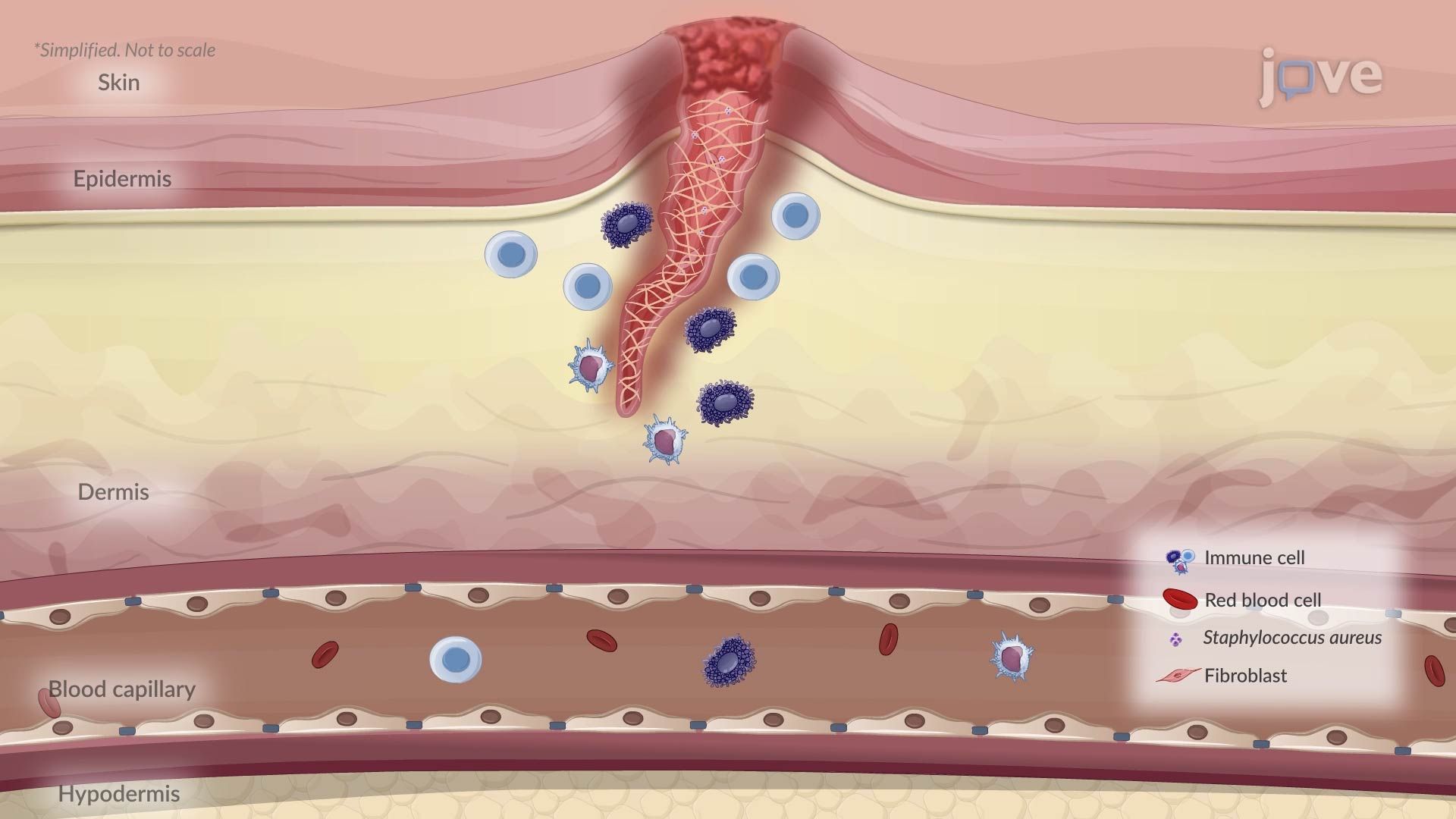Chronic Inflammation: Introduction – Practice Quiz | JoVE Core