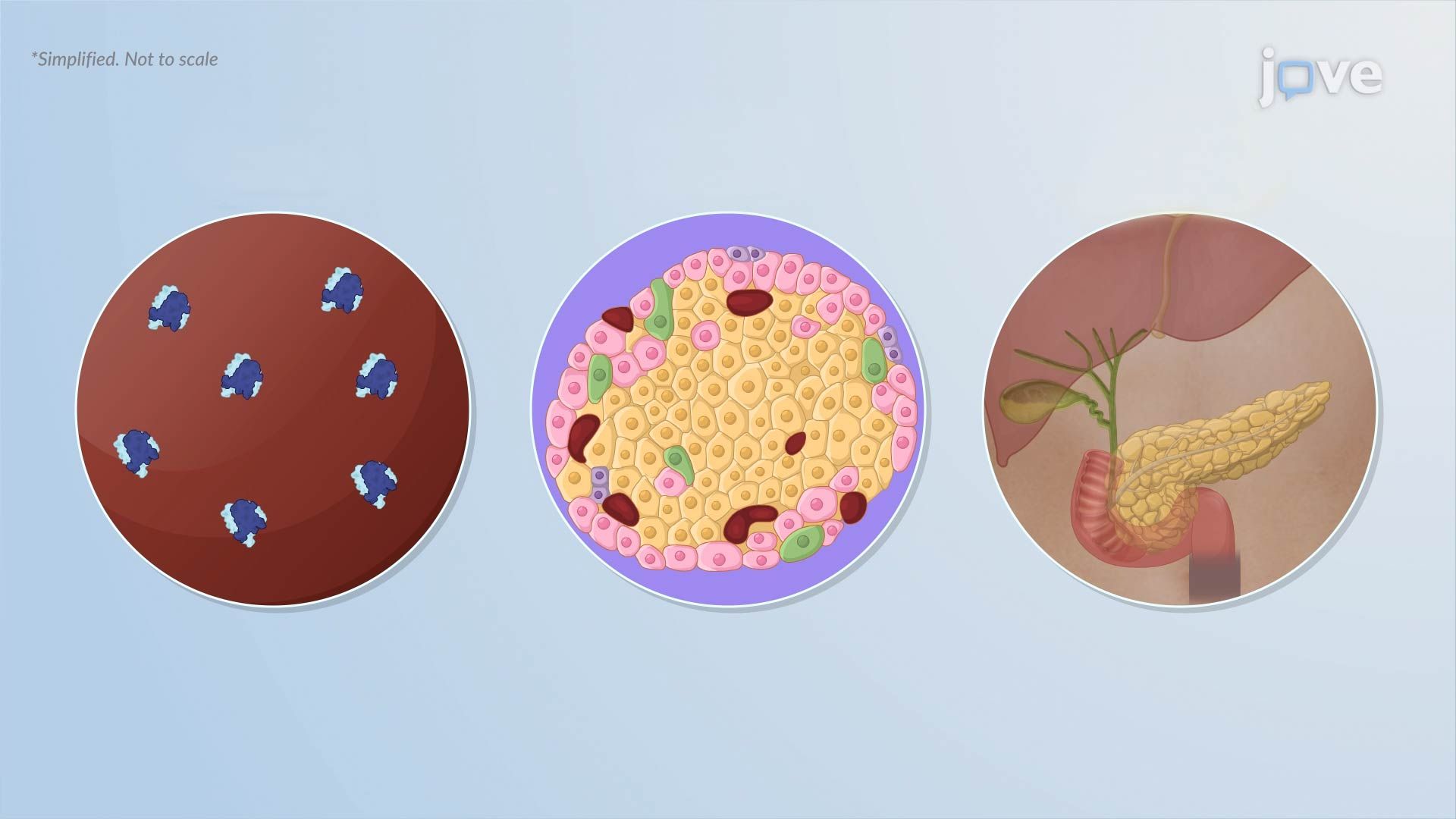 Video: Diabetes Mellitus: Introduction