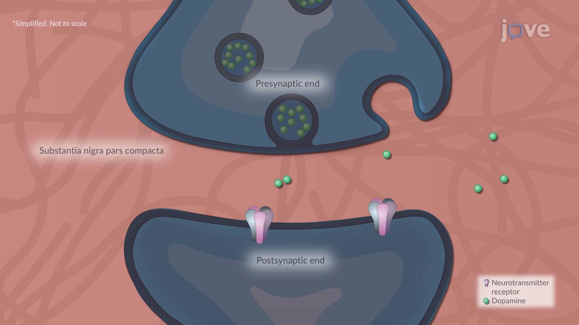 Video: Parkinson Disease l: Introduction