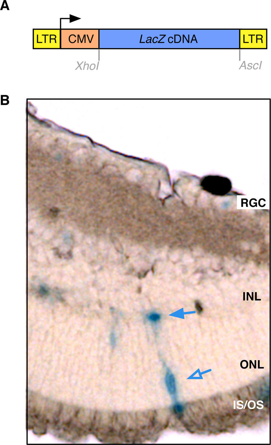 Subretinal Injection of Gene Therapy Vectors and Stem Cells in the ...