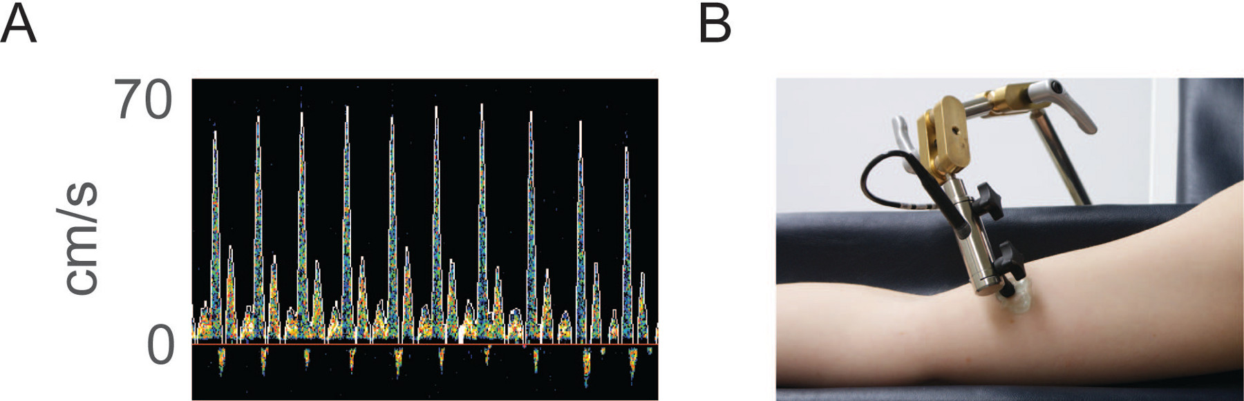 Tilt Testing with Combined Lower Body Negative Pressure: a "Gold ...