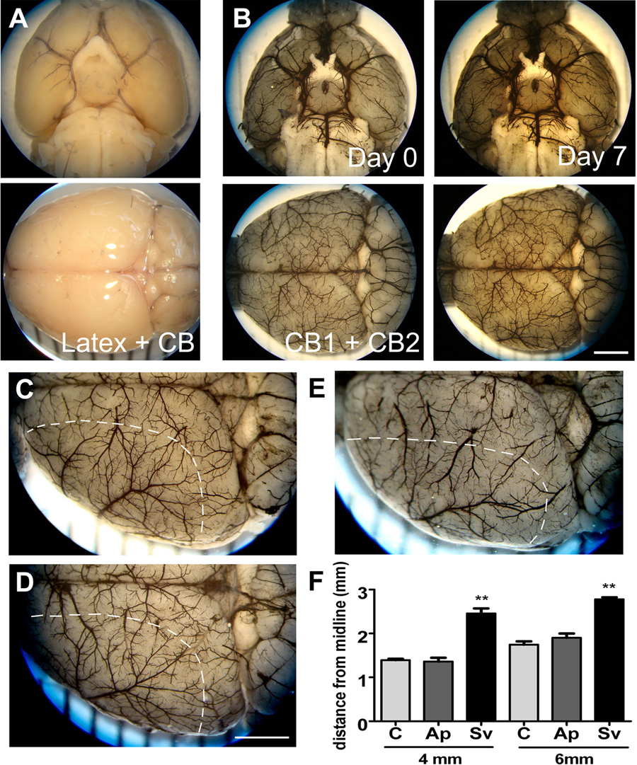 Intravascular Perfusion of Carbon Black Ink Allows Reliable ...