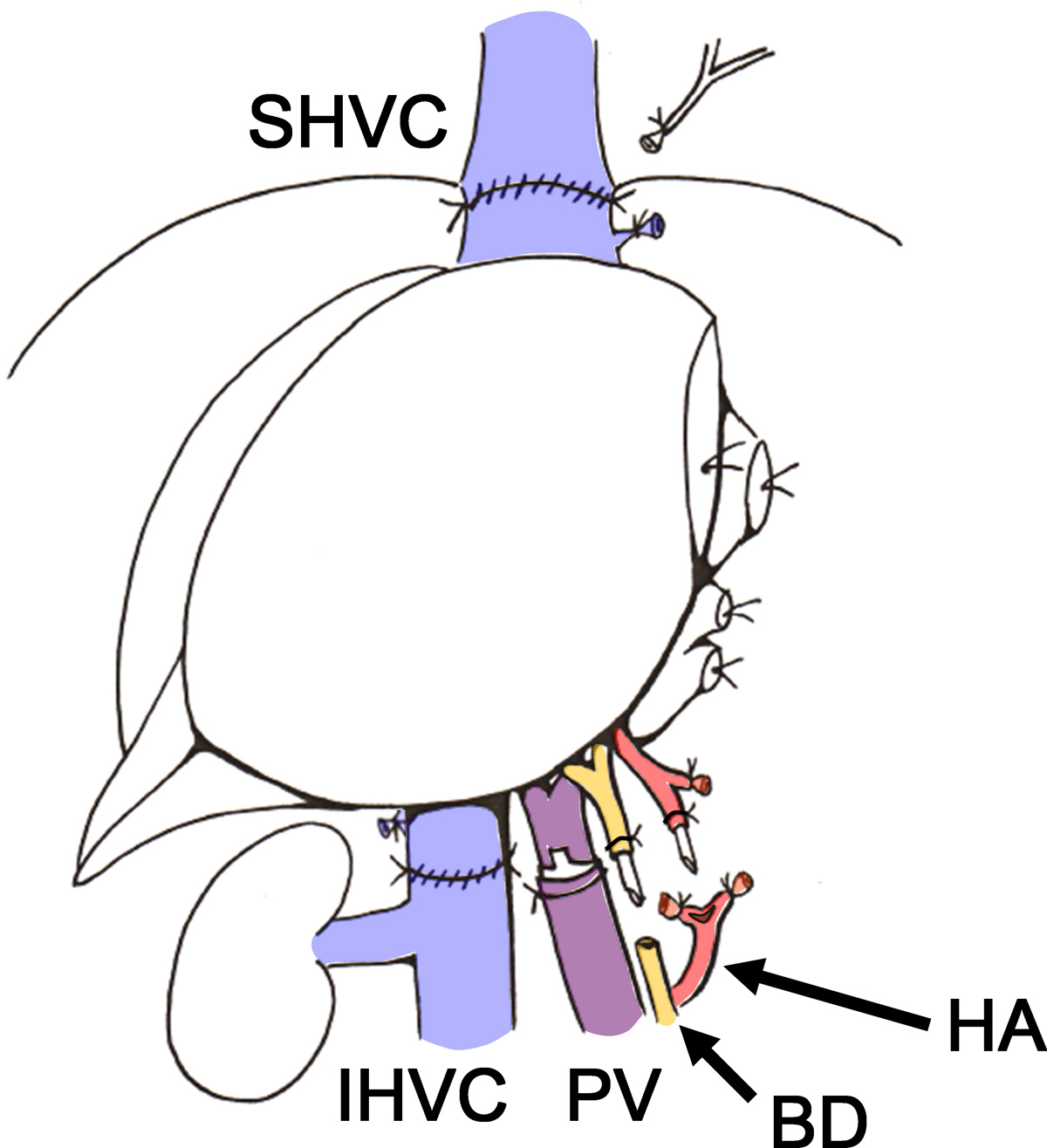Surgical Procedures for a Rat Model of Partial Orthotopic Liver ...