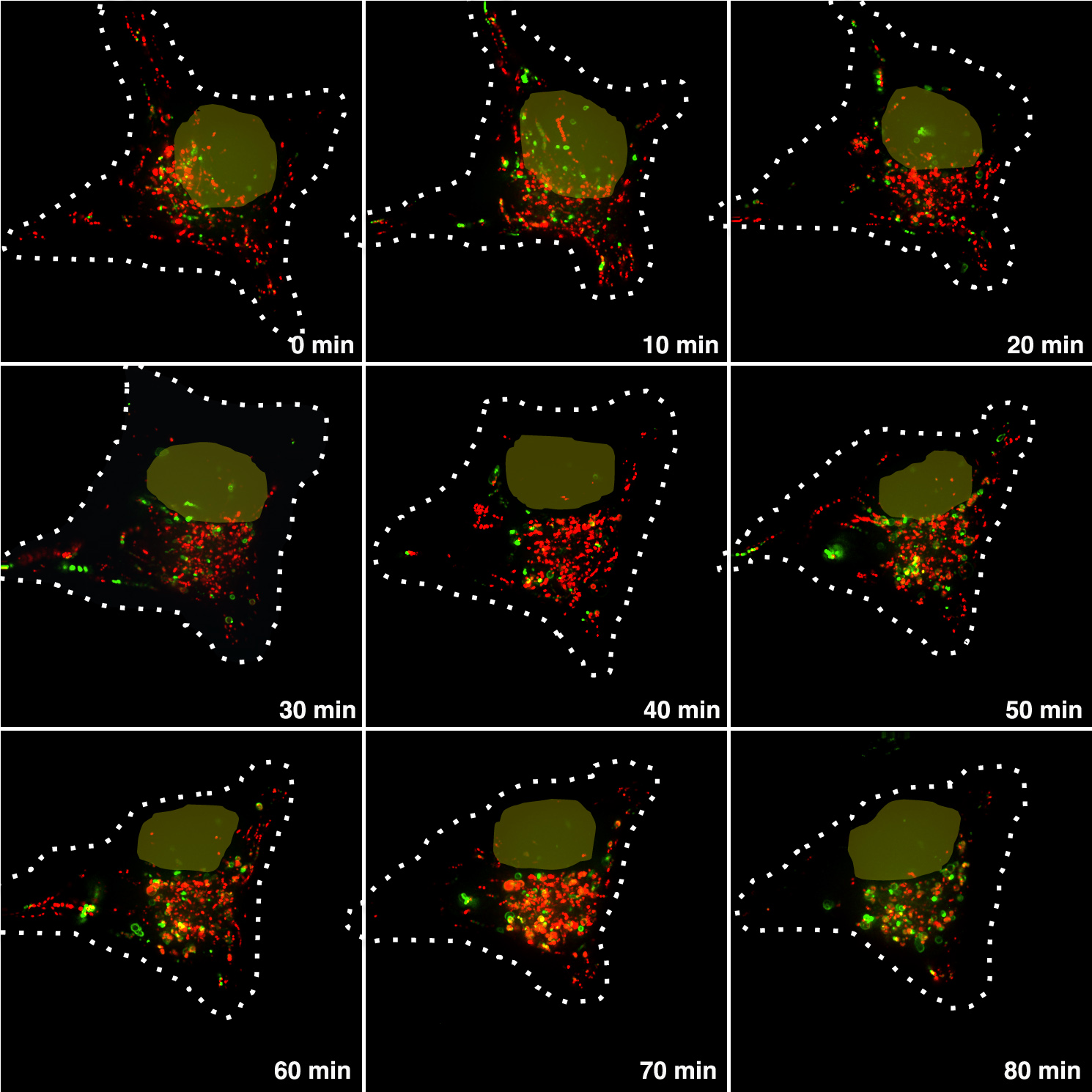 Quantitative Analysis of Autophagy using Advanced 3D Fluorescence Microscopy | Protocol
