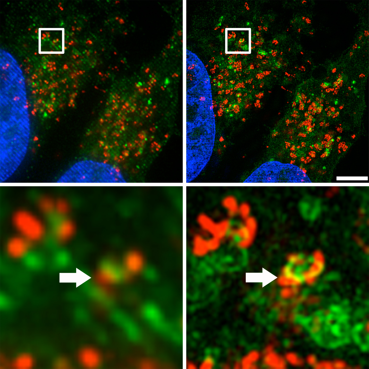 Quantitative Analysis of Autophagy using Advanced 3D Fluorescence Microscopy (Scientific Article ...