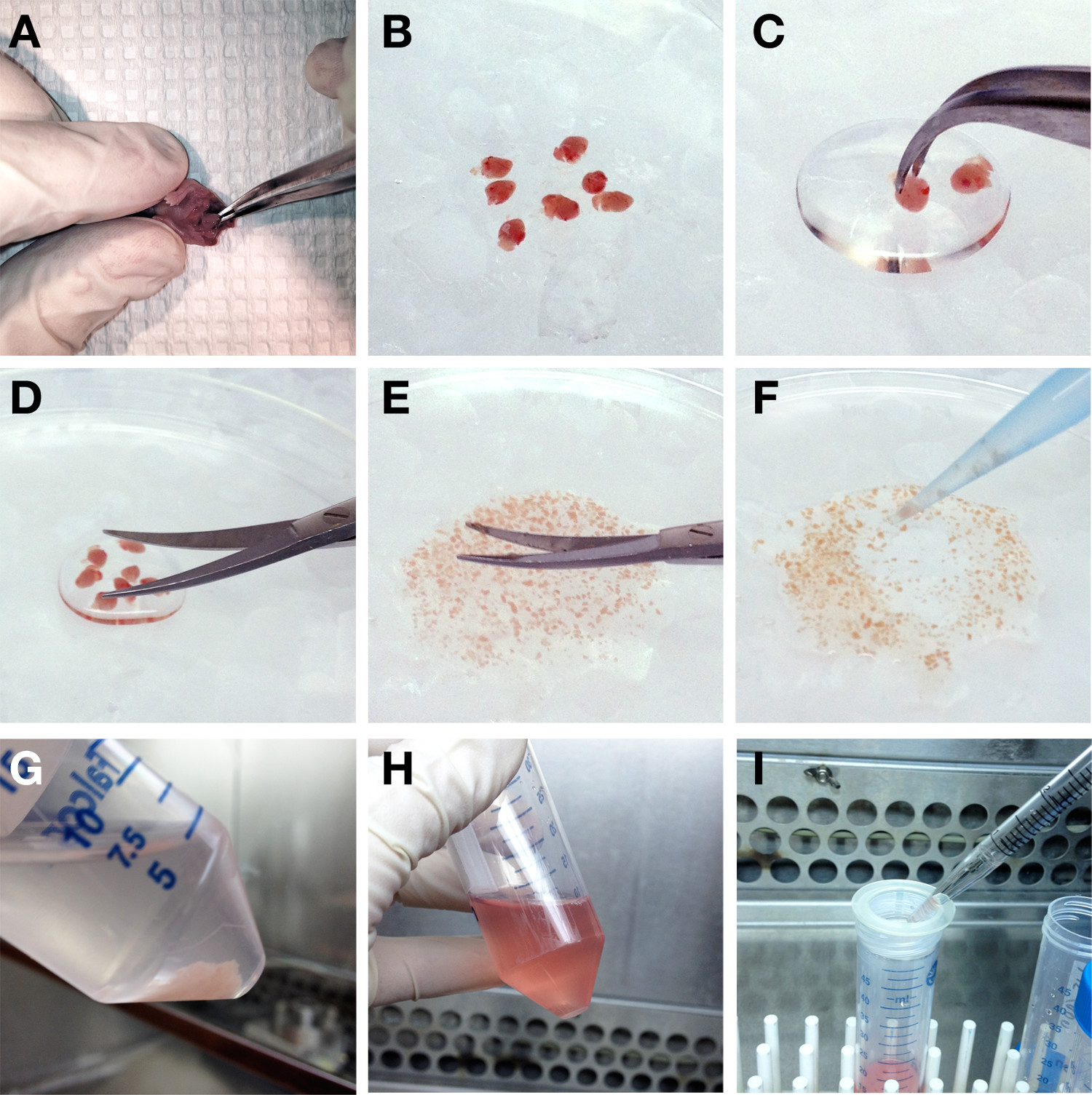 Isolation and Culture of Neonatal Mouse Cardiomyocytes (Scientific ...