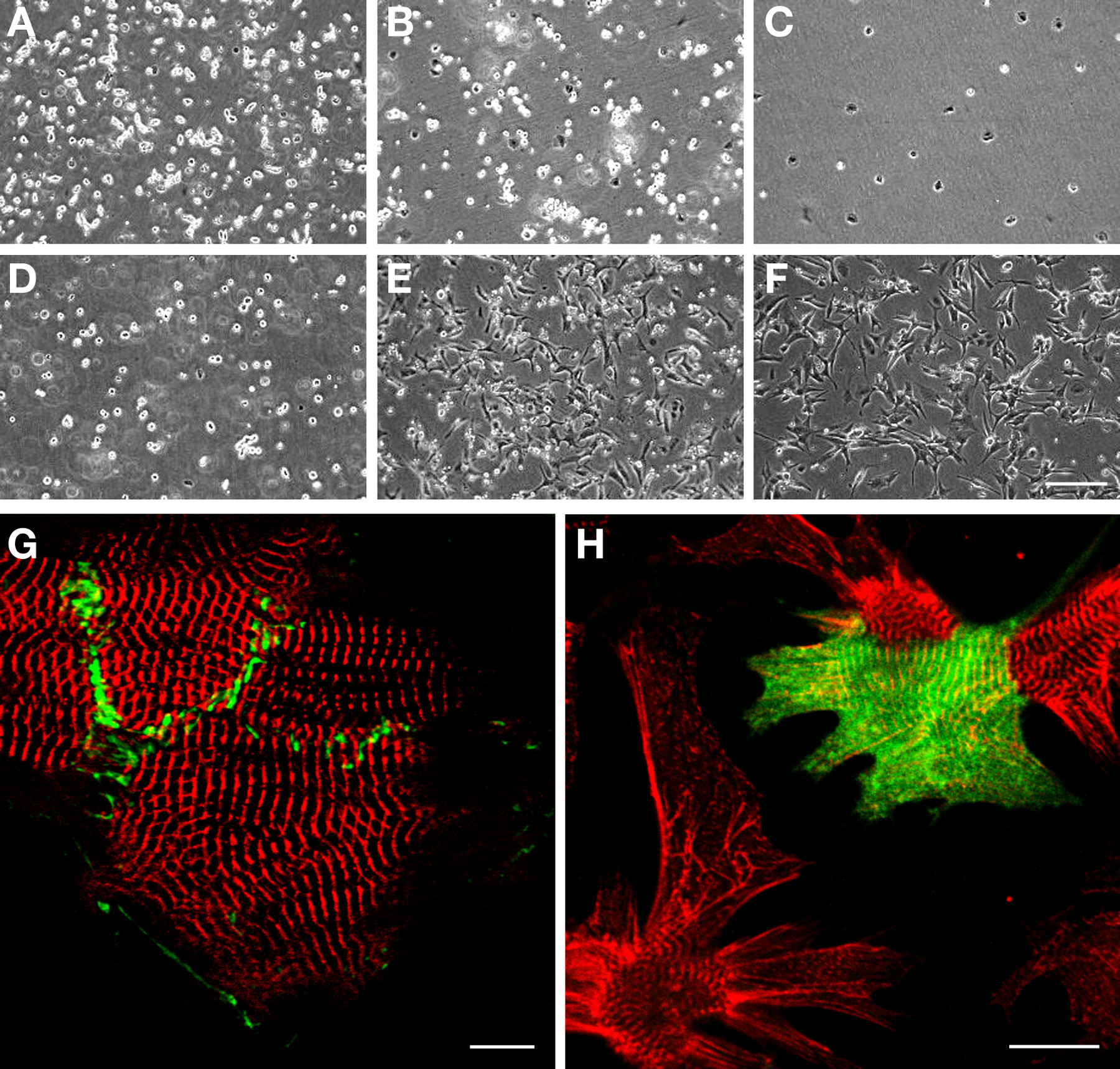 Isolation and Culture of Neonatal Mouse Cardiomyocytes