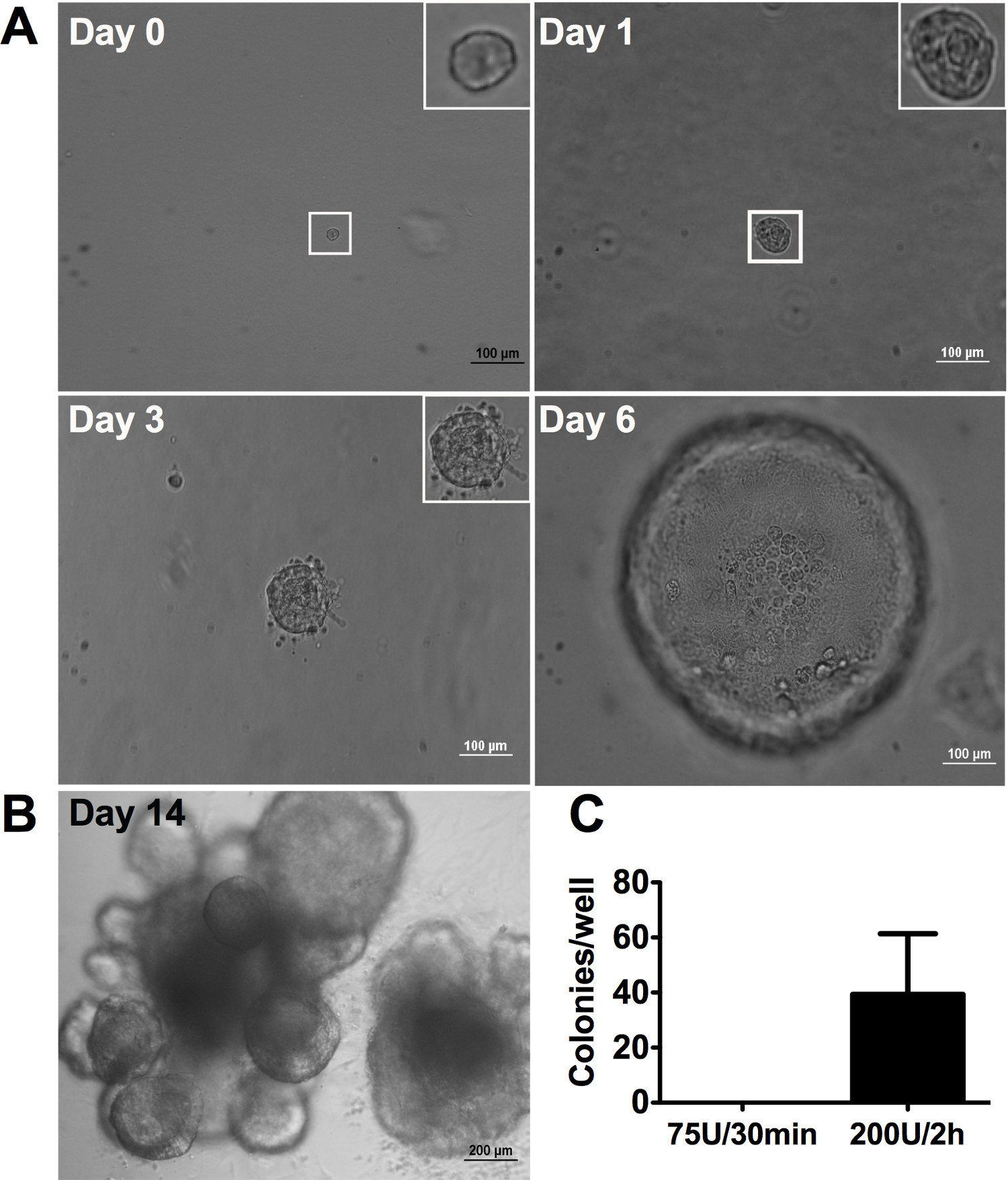 In vitro Organoid Culture of Primary Mouse Colon Tumors (Scientific ...