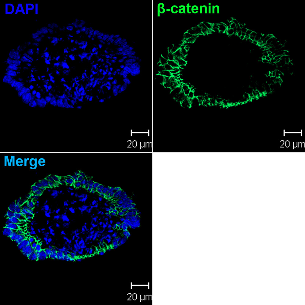 In vitro Organoid Culture of Primary Mouse Colon Tumors | Protocol