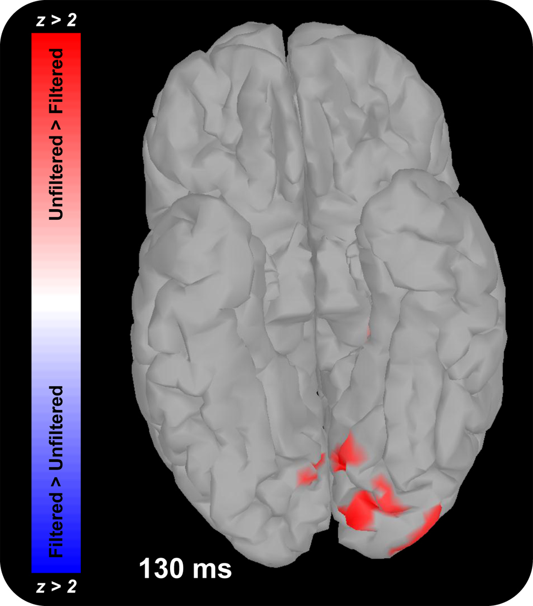Detecting Amygdala Activity with Magnetoencephalography | Protocol