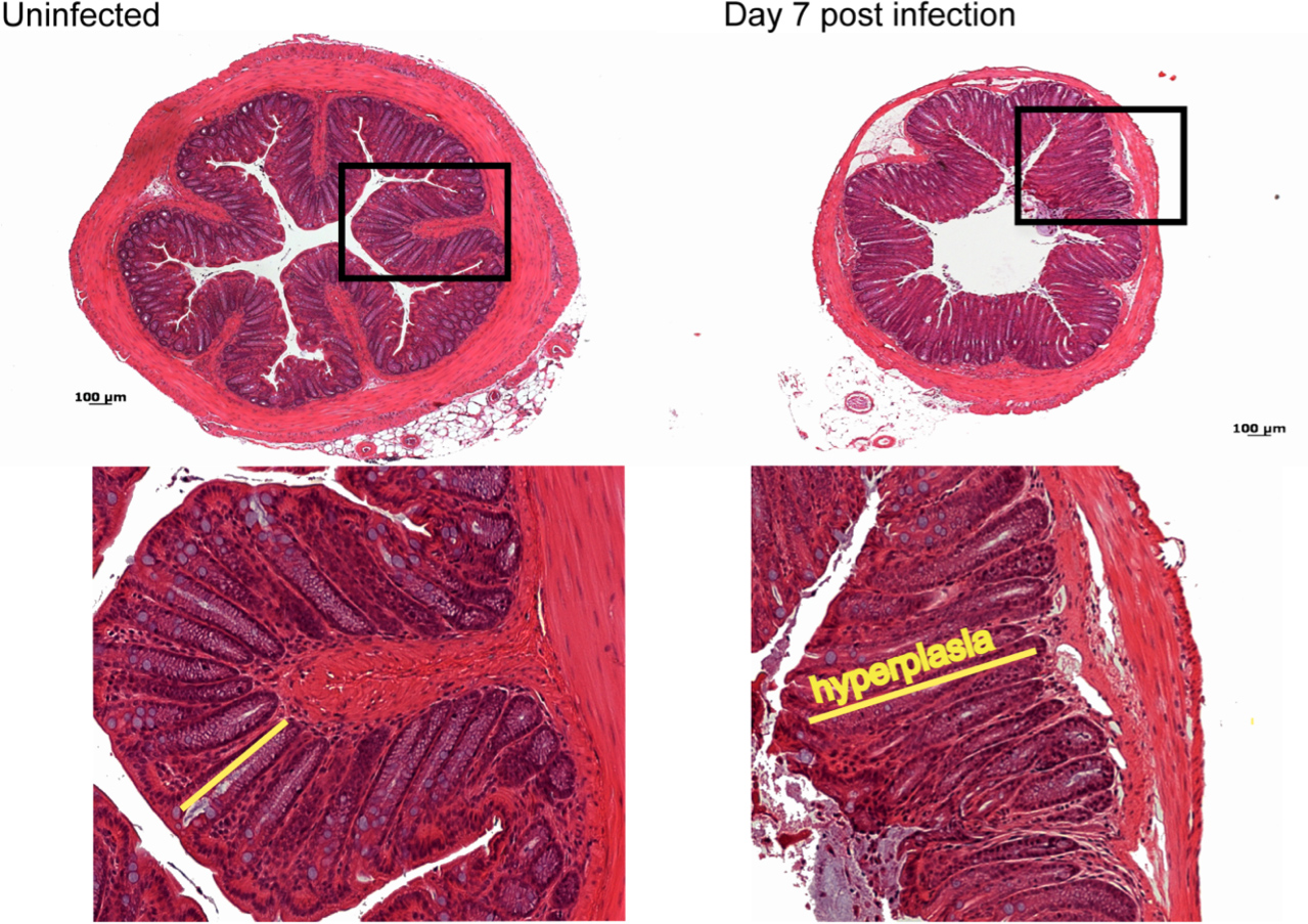 The Citrobacter rodentium Mouse Model: Studying Pathogen and Host ...