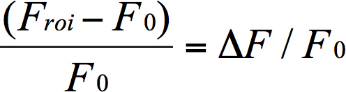 Direct Imaging of ER Calcium with Targeted-Esterase Induced Dye Loading ...