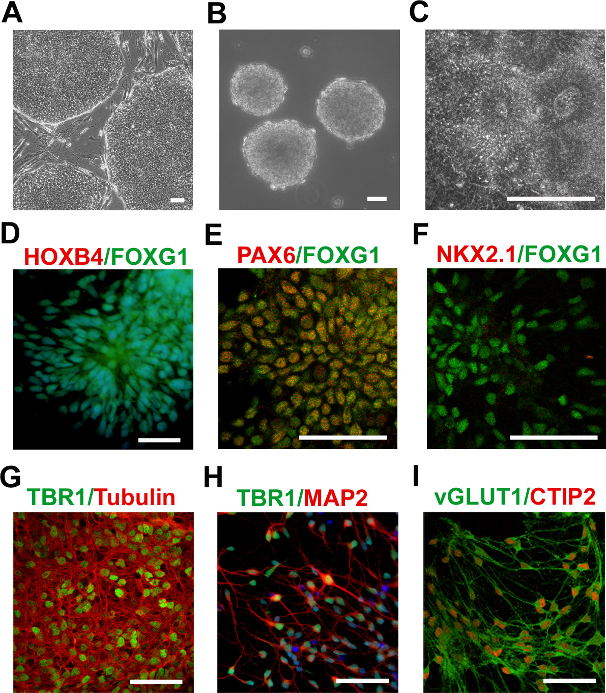 The Specification of Telencephalic Glutamatergic Neurons from Human ...