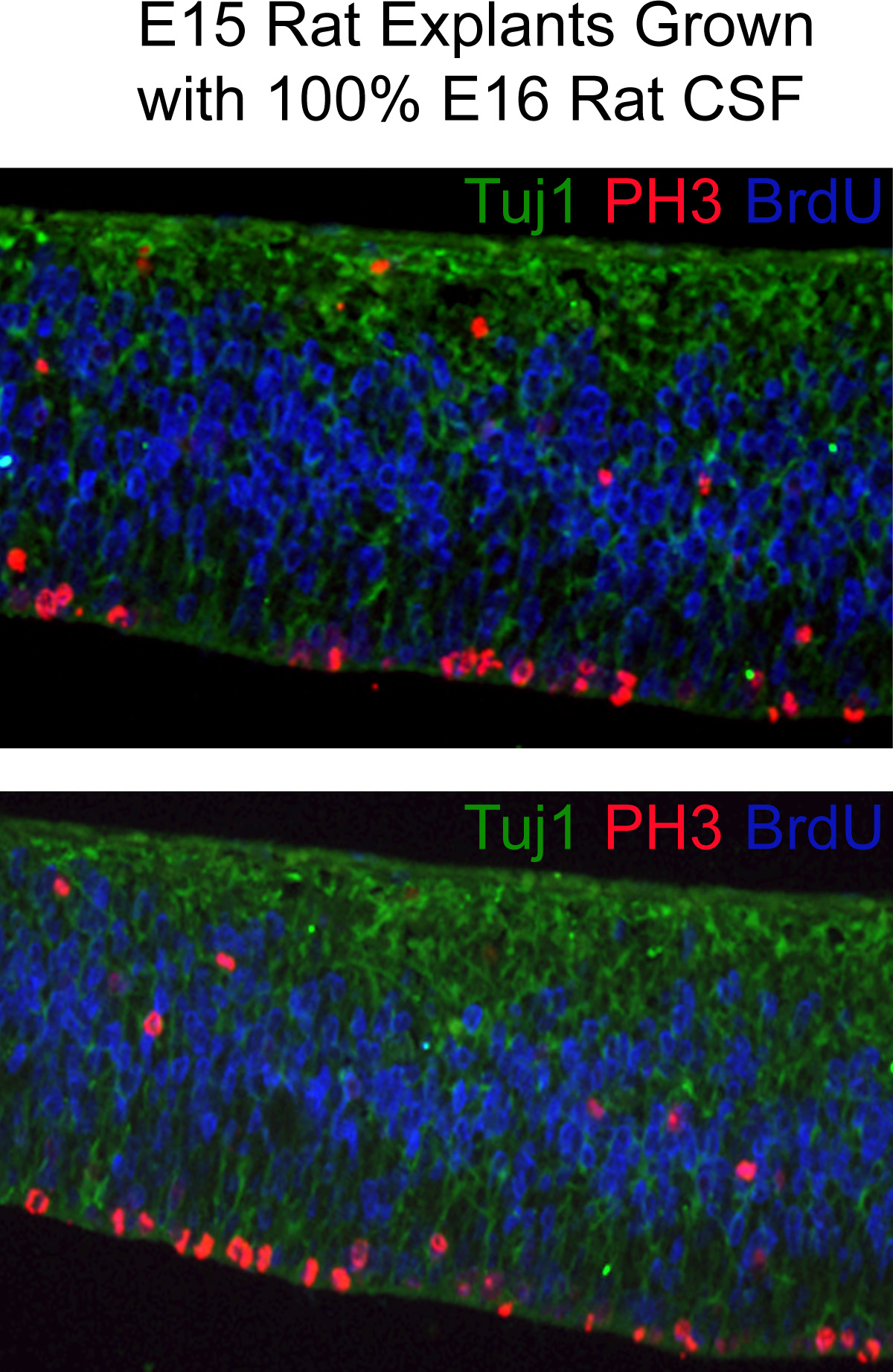 Isolation of Cerebrospinal Fluid from Rodent Embryos for use with ...