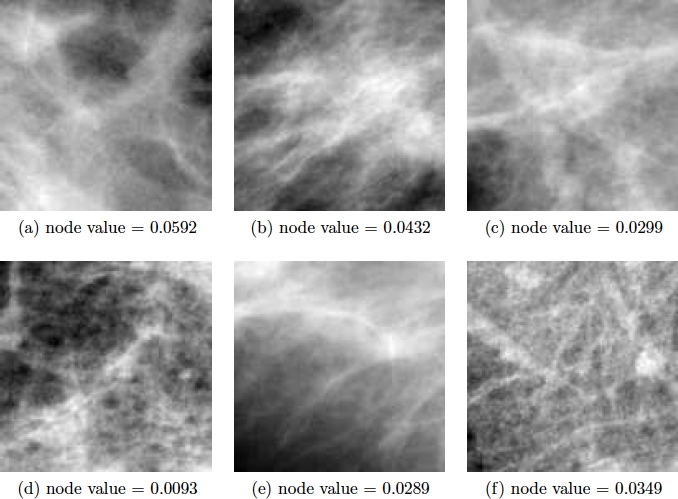 Detection Of Architectural Distortion In Prior Mammograms Via Analysis Of Oriented Patterns