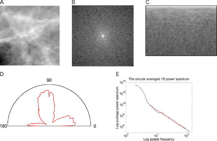 Detection Of Architectural Distortion In Prior Mammograms Via Analysis Of Oriented Patterns