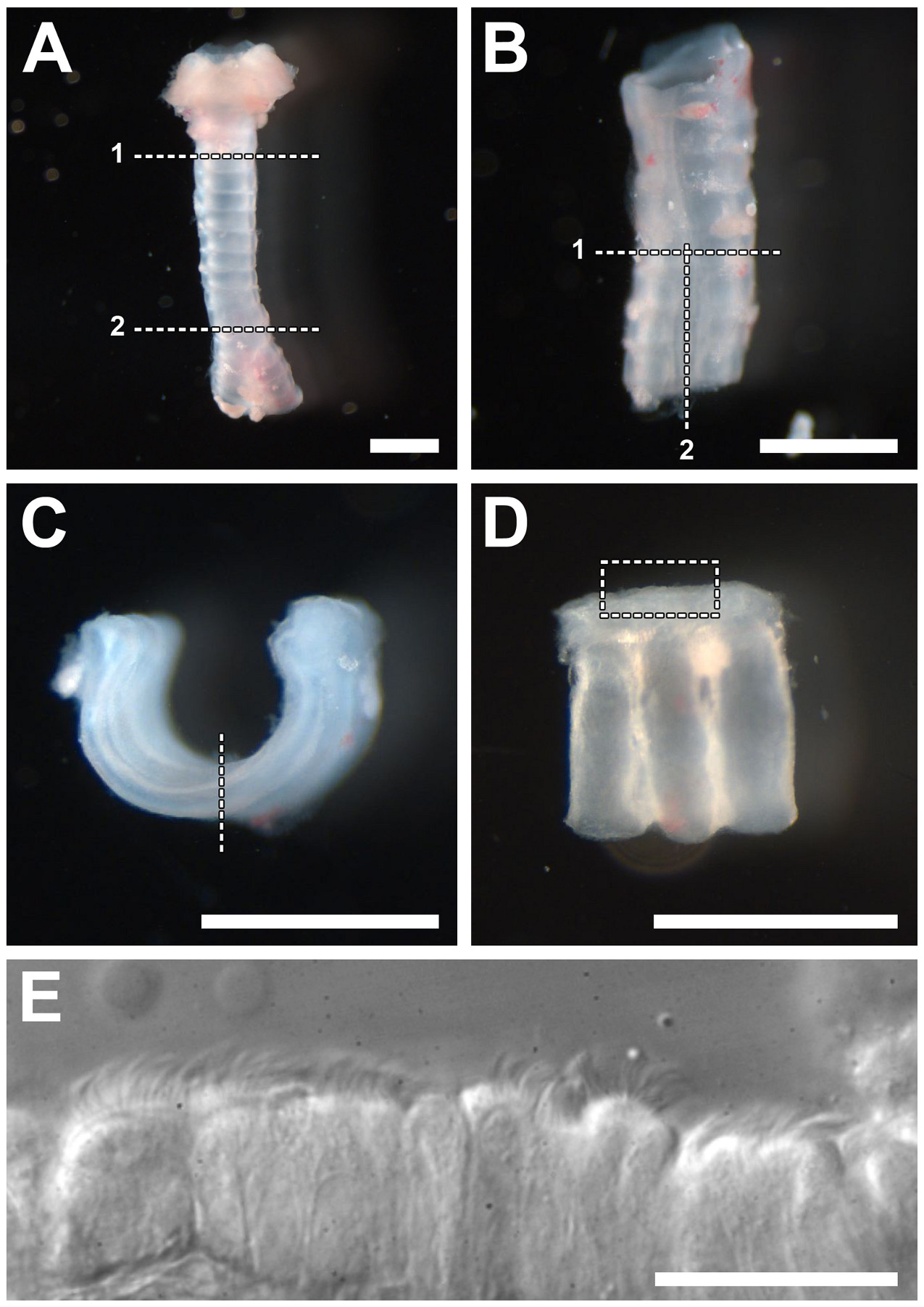 Ex vivo Method for High Resolution Imaging of Cilia Motility in Rodent ...