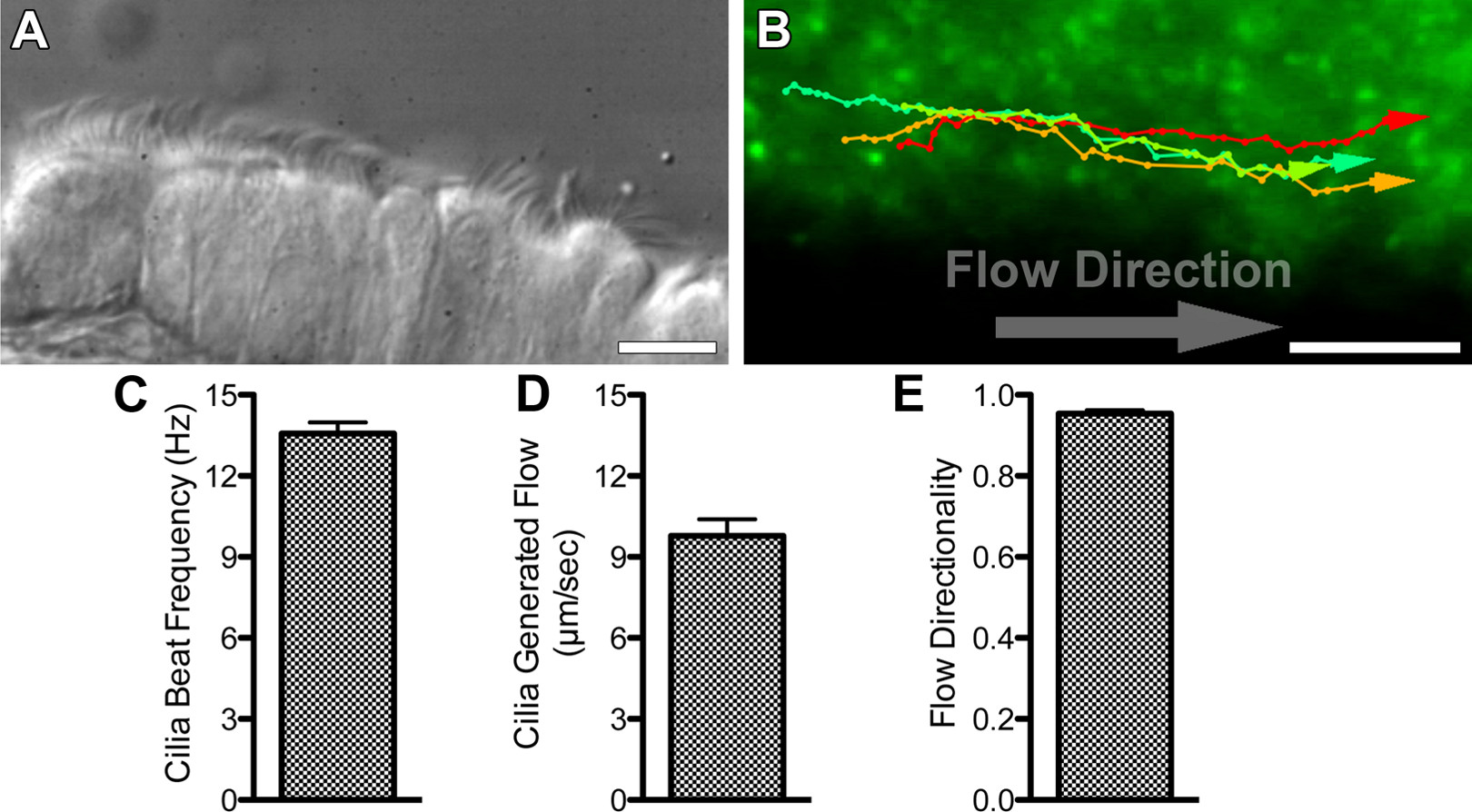 Ex vivo Method for High Resolution Imaging of Cilia Motility in Rodent ...