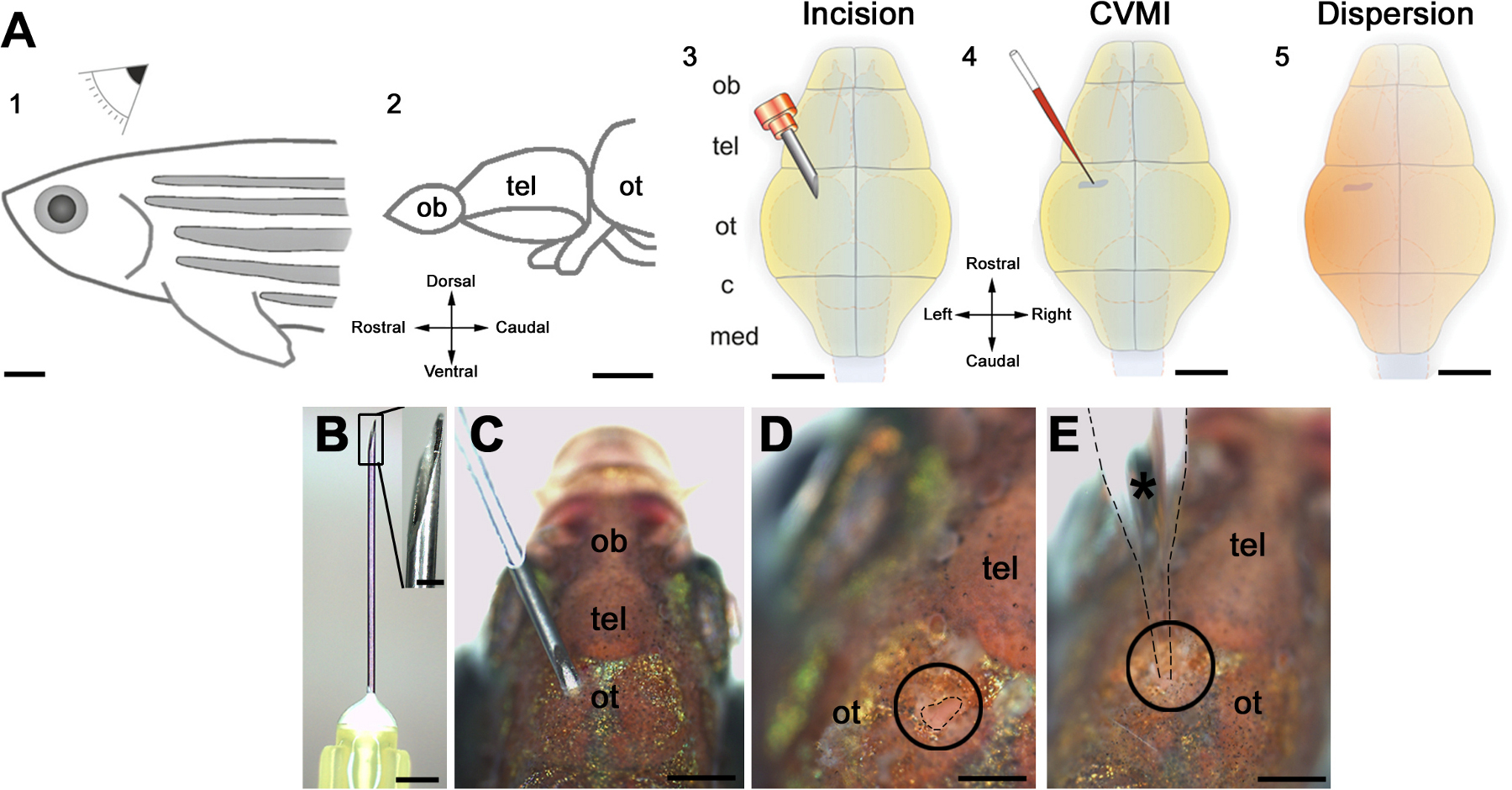 Micromanipulation of Gene Expression in the Adult Zebrafish Brain Using ...