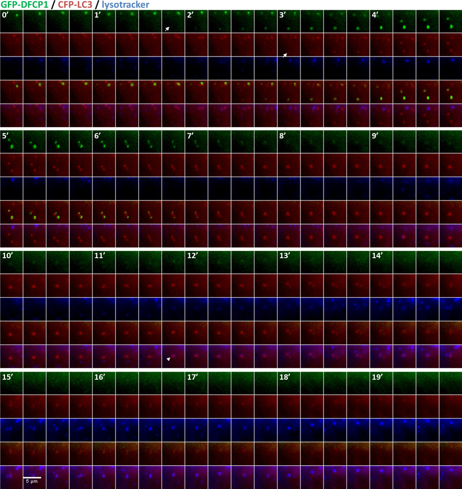 Live Cell Imaging of Early Autophagy Events: Omegasomes and Beyond ...