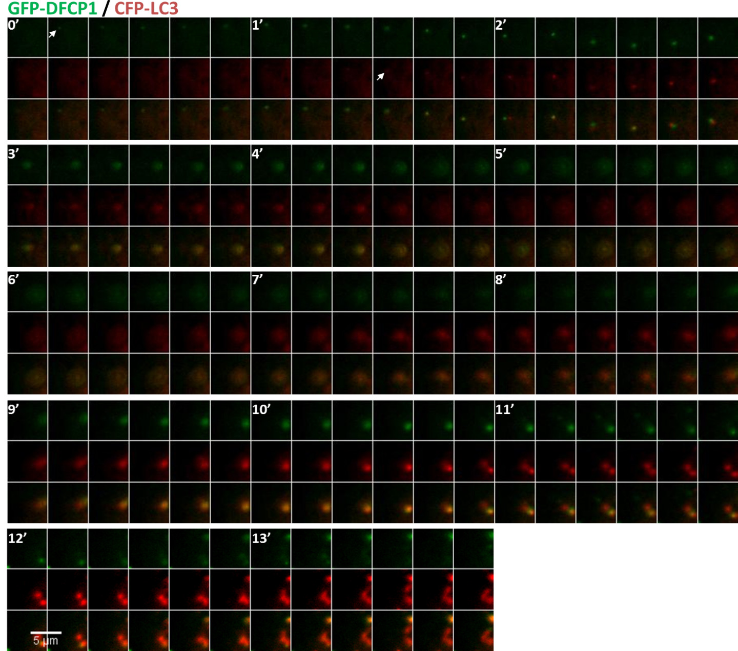 Live Cell Imaging of Early Autophagy Events: Omegasomes and Beyond ...