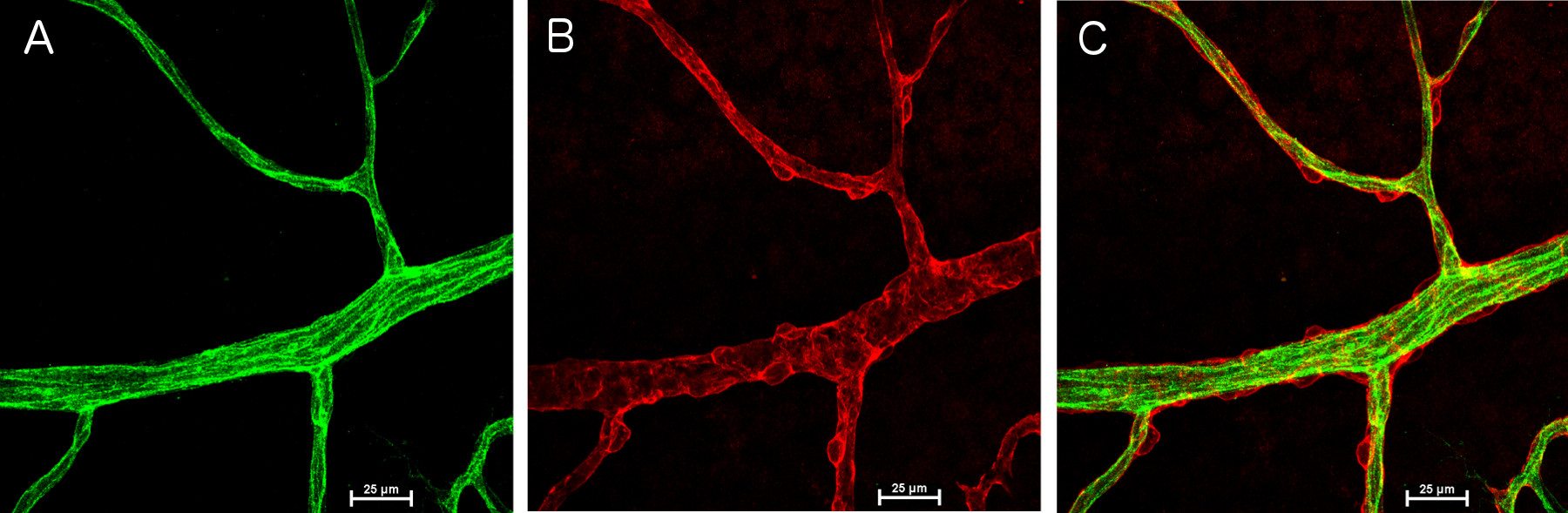 Whole Mount Immunofluorescent Staining of the Neonatal Mouse Retina to ...