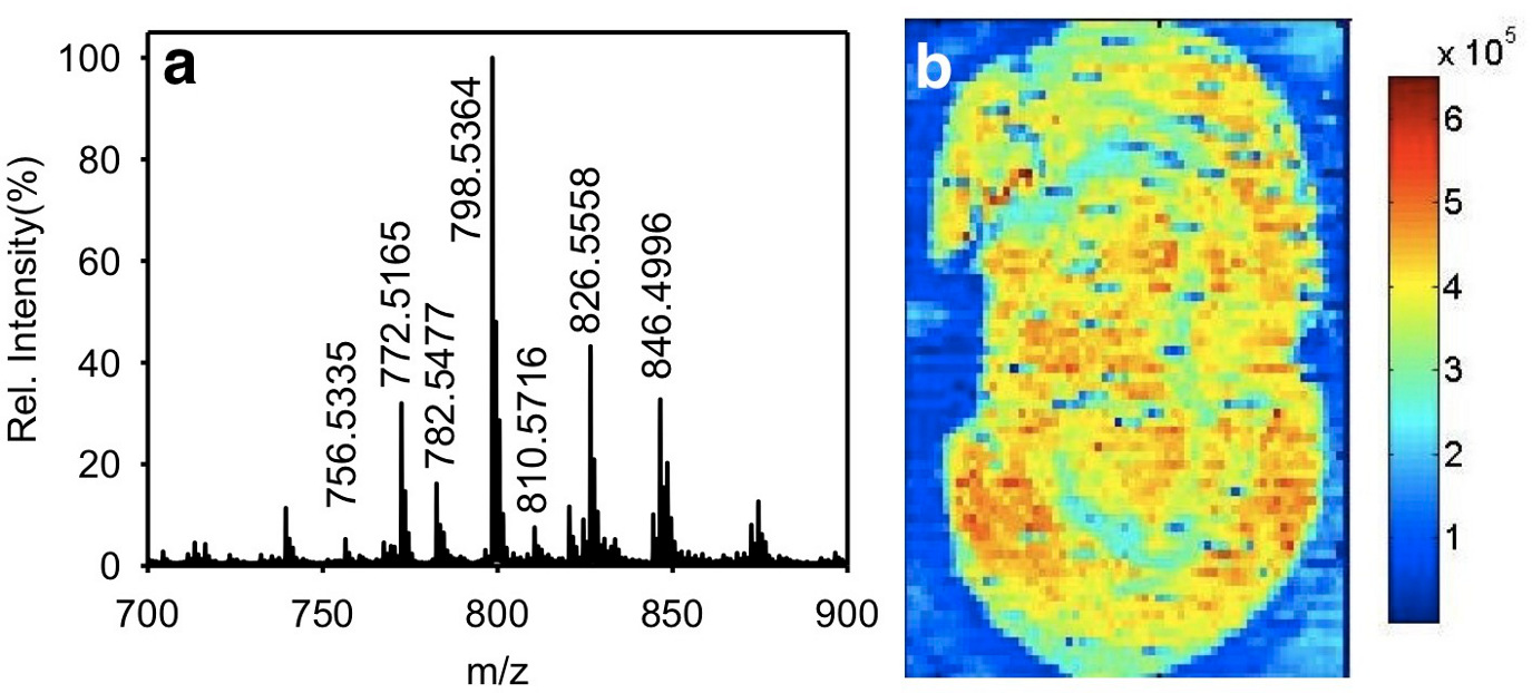 Imaging of Biological Tissues by Desorption Electrospray Ionization ...