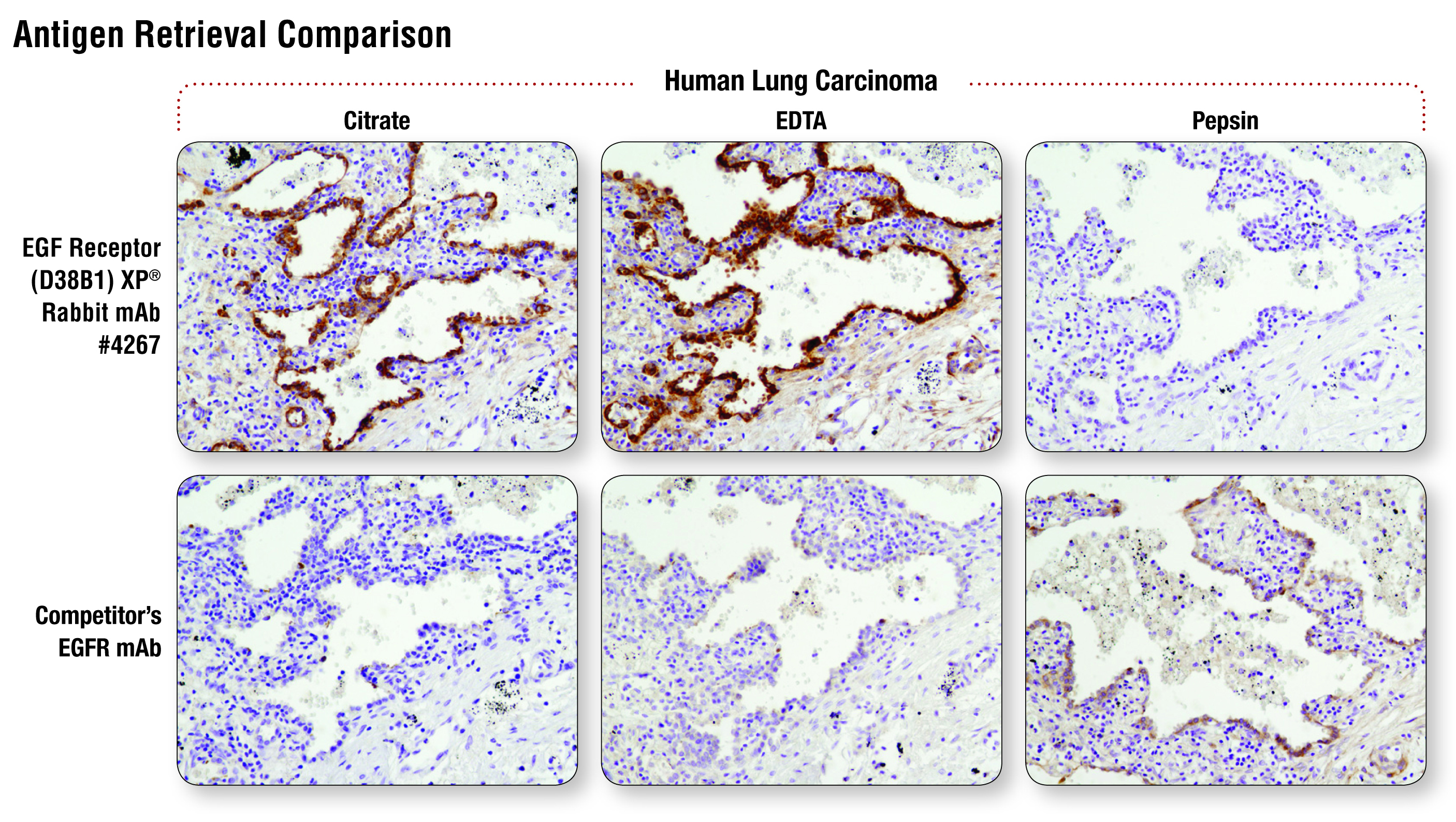 ihc fr vs ihc p