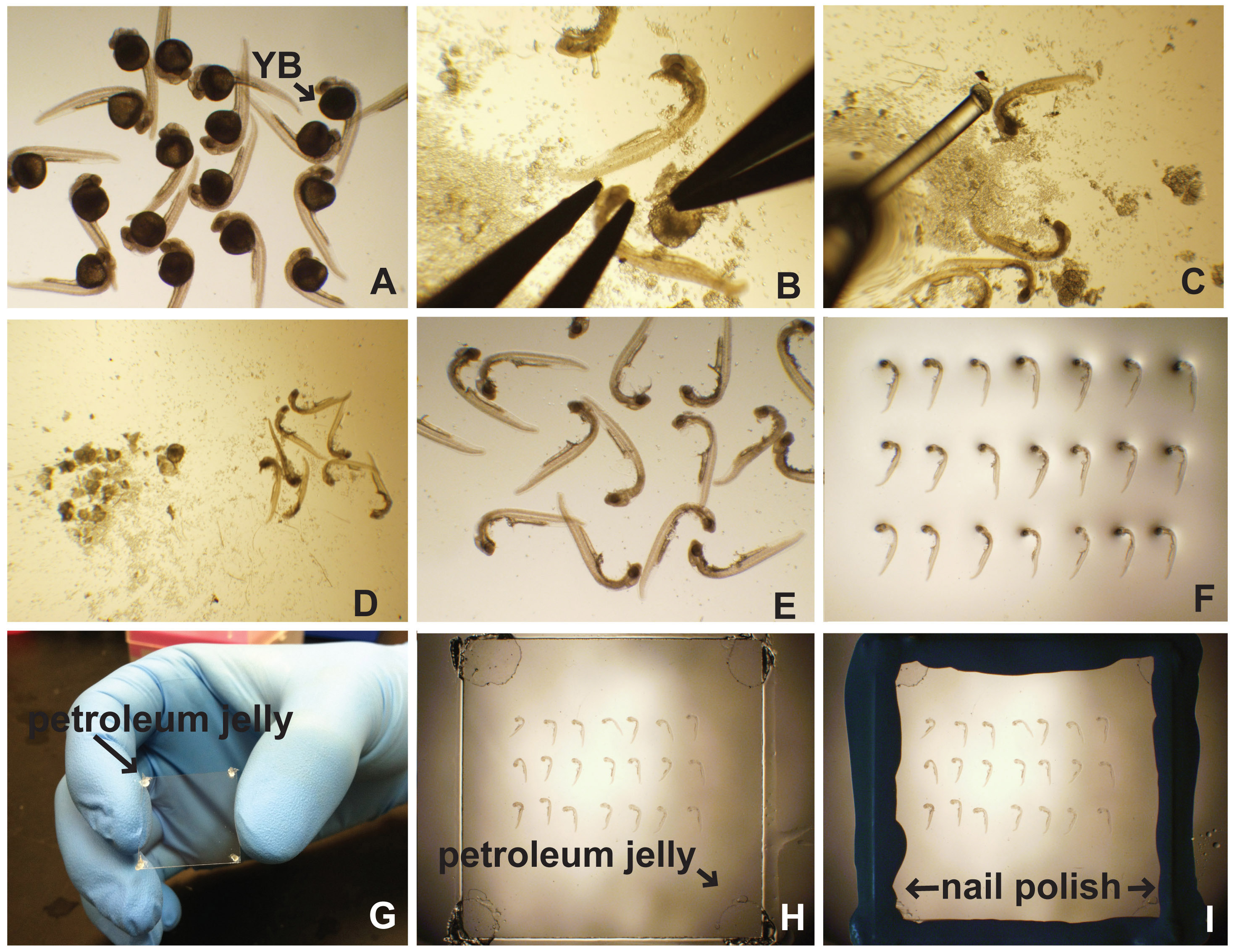 Dissection and Lateral Mounting of Zebrafish Embryos: Analysis of ...