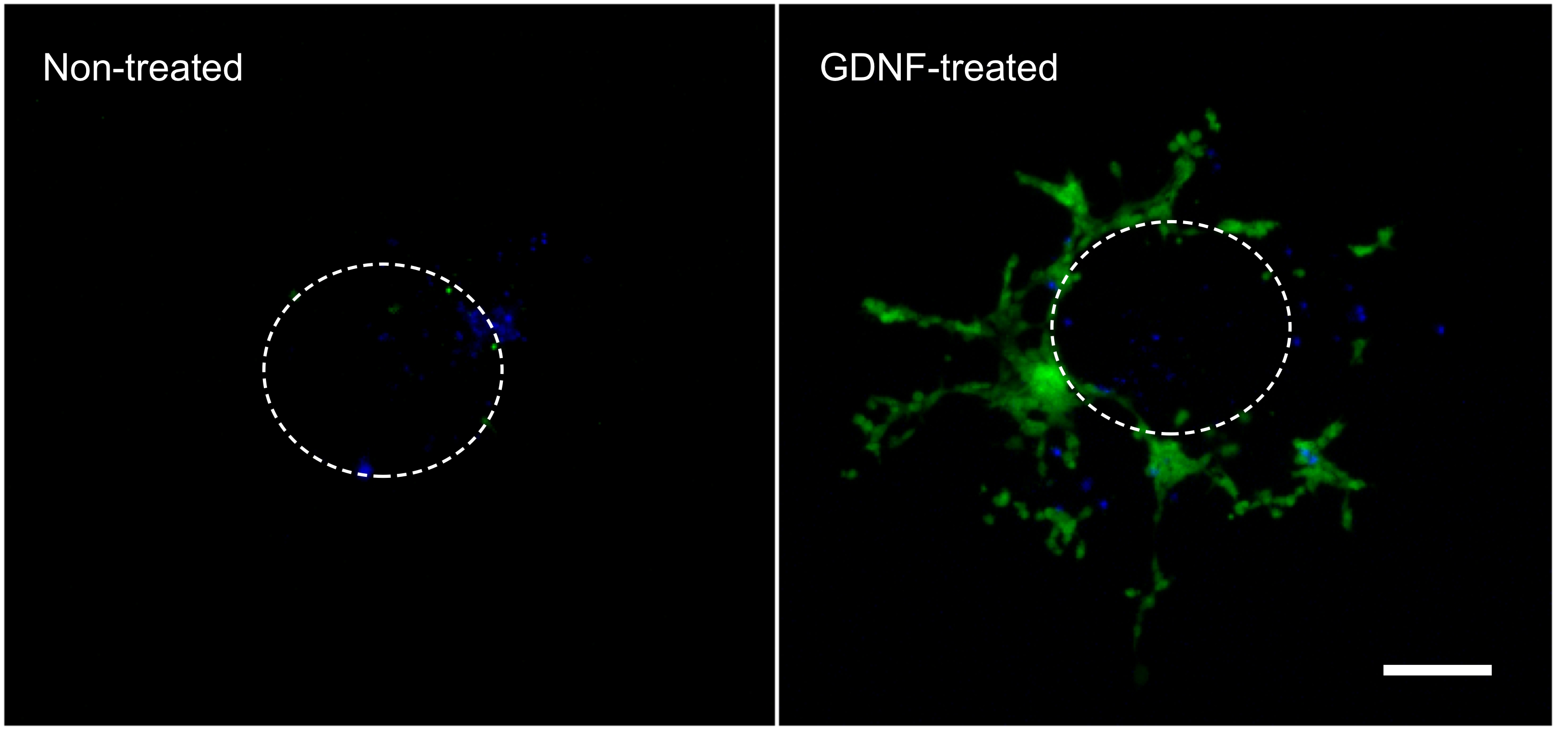 A Quantitative Cell Migration Assay For Murine Enteric Neural 4193