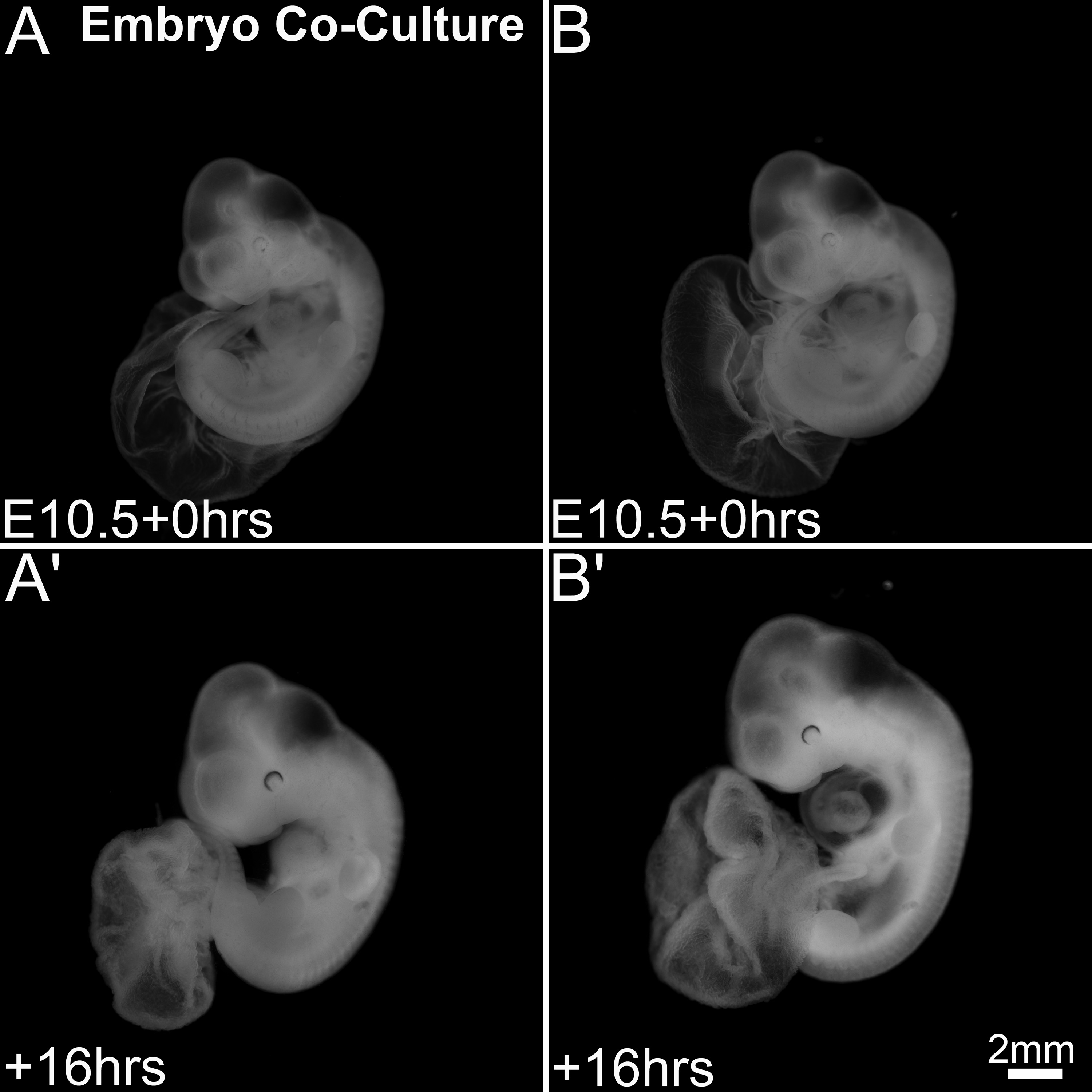 Mouse Embryonic Development in a Serum-free Whole Embryo Culture System