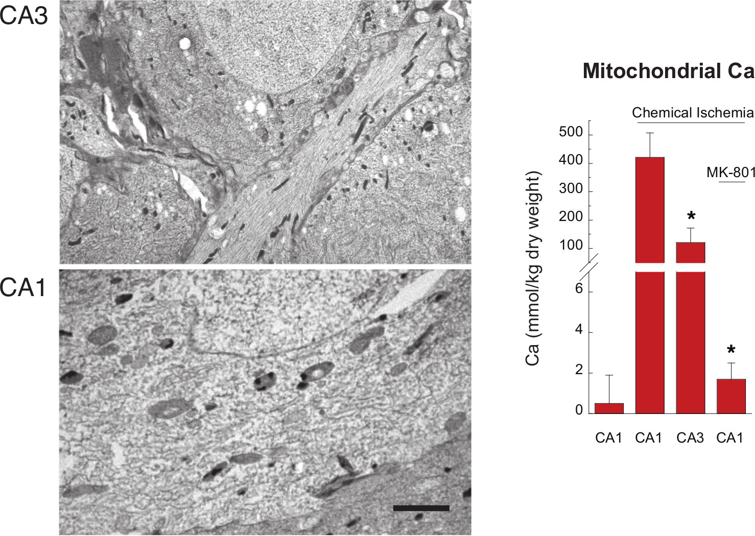 Measurement of Total Calcium in Neurons by Electron Probe X-ray ...